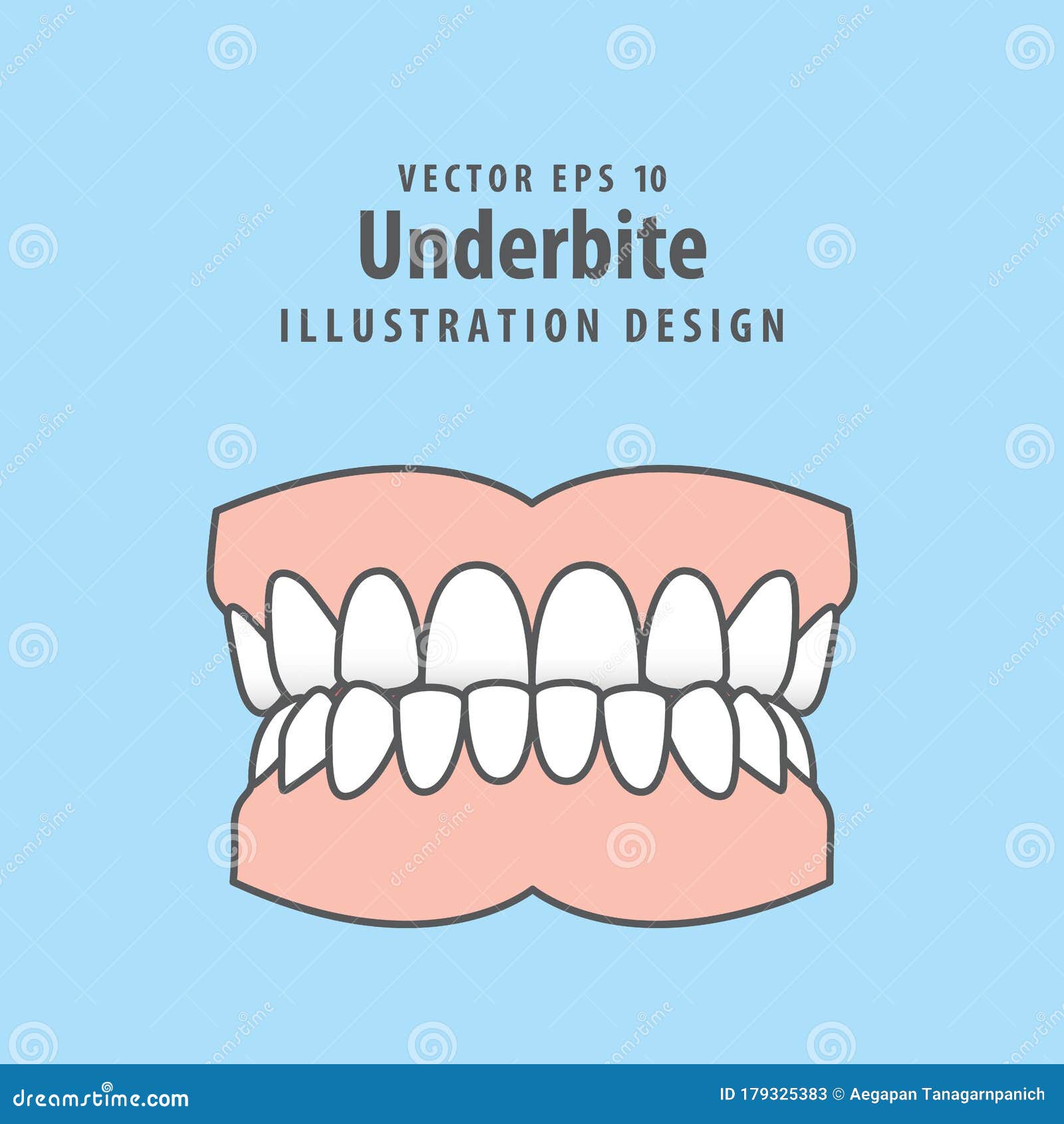Dental Underbite Teeth Illustration Vector Design on Blue Background ...