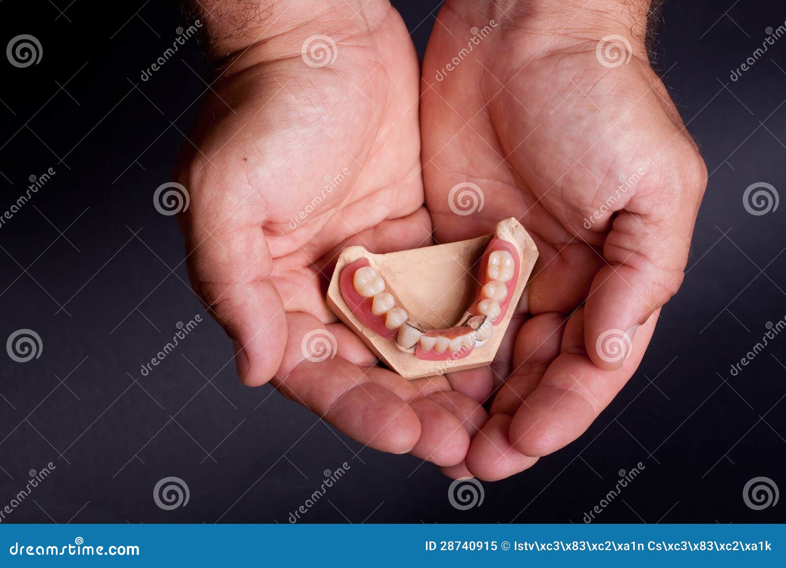 Dental wax model stock image. Image of bridge, molars - 28740915