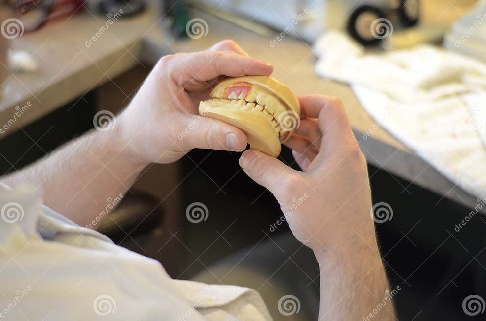 Dental work stock image. Image of correction, medical - 30365205