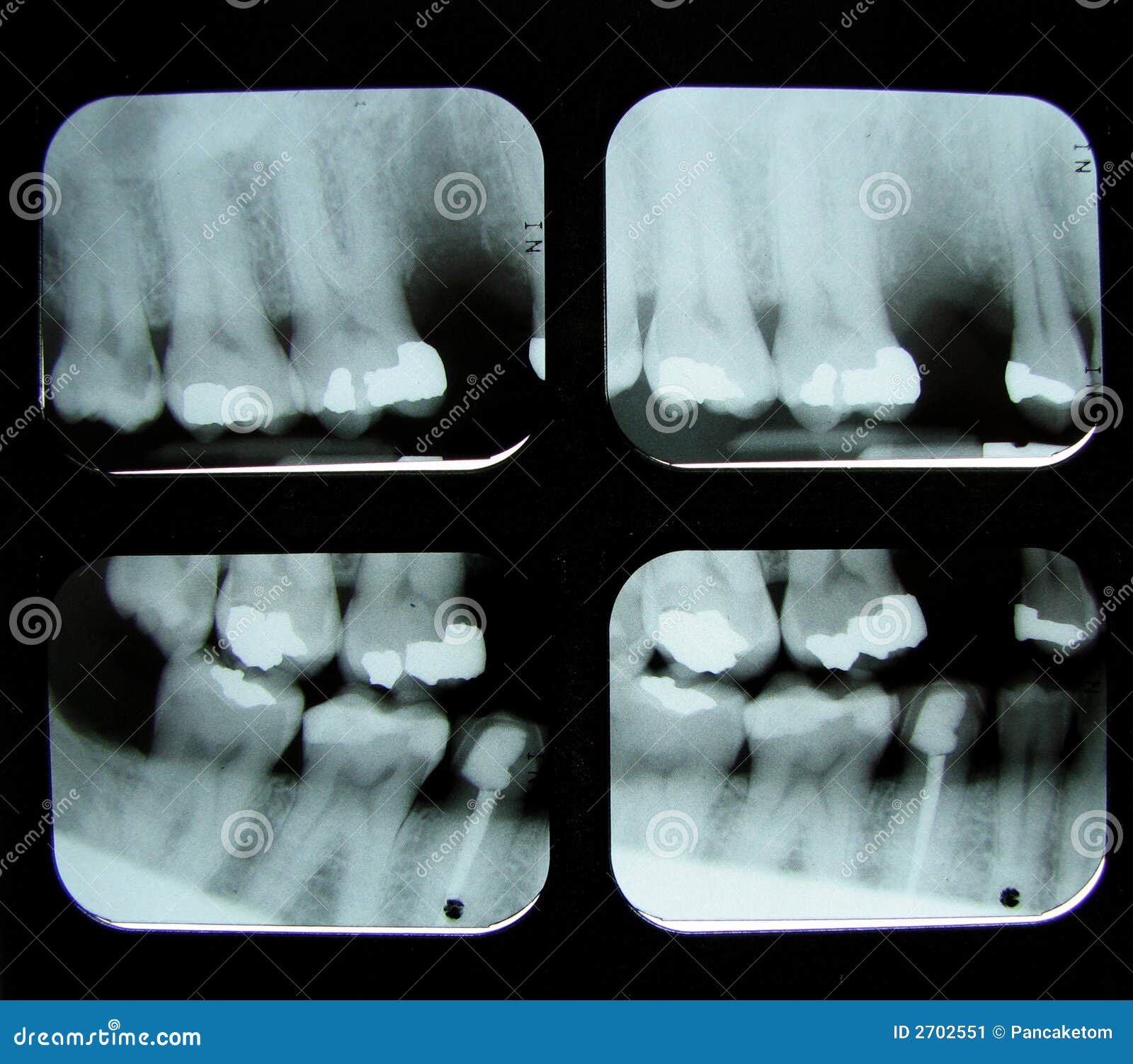Dental X-rays Stock Image - Image: 2702551