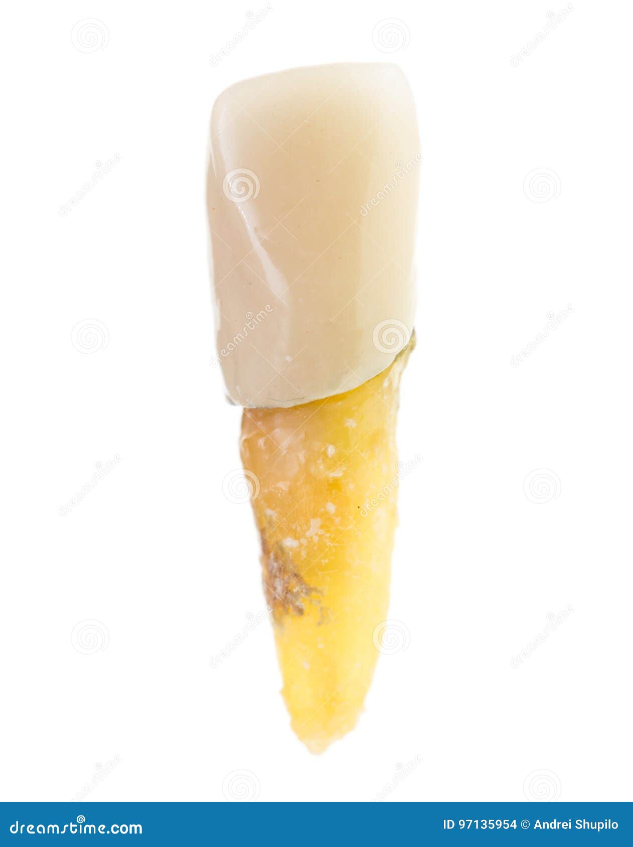 Dente Rasgado Velho Em Um Fundo Branco Foto de Stock - Imagem de ...