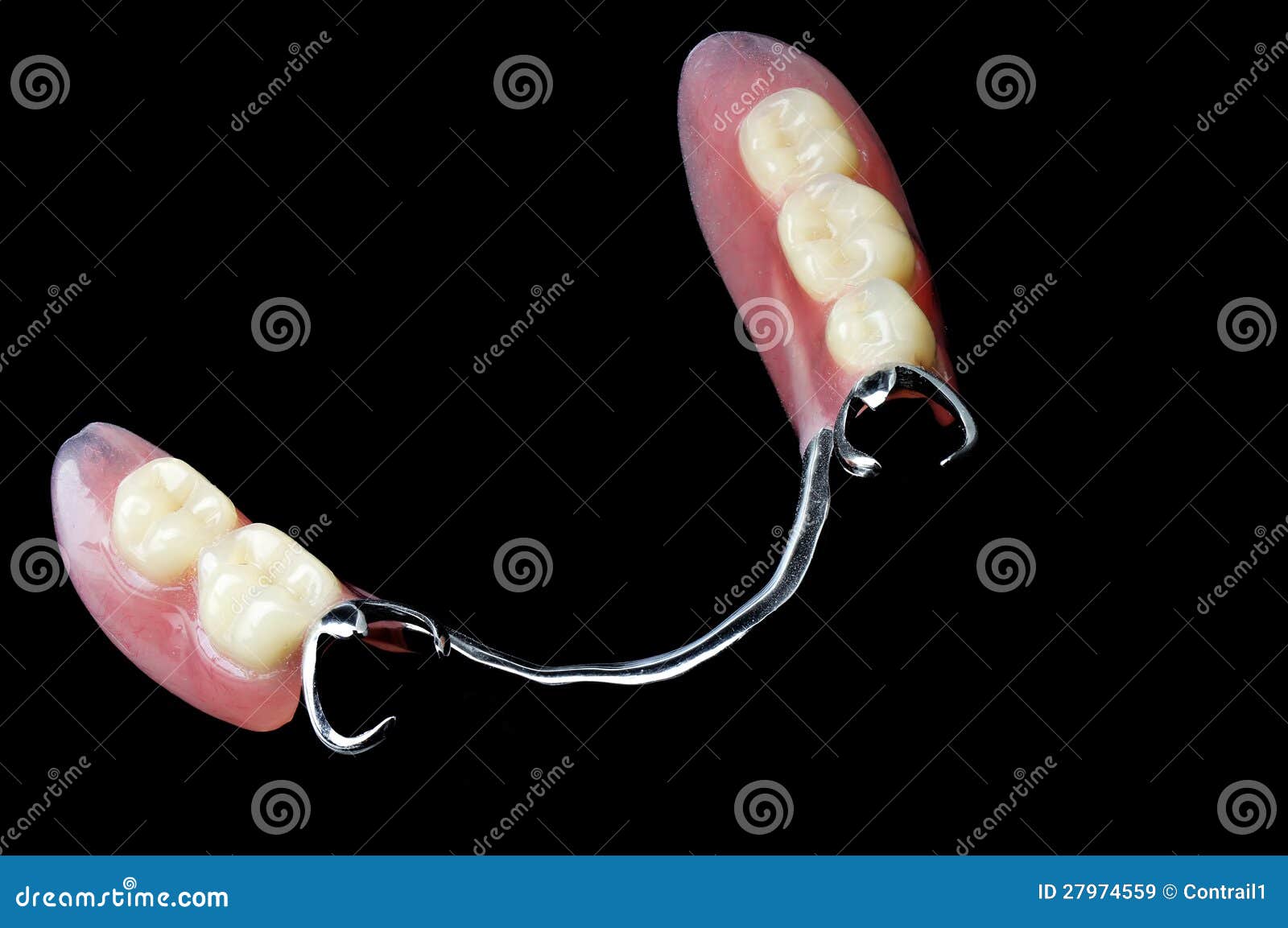 Dentier image stock. Image du substitut, métal, médecine - 27974559