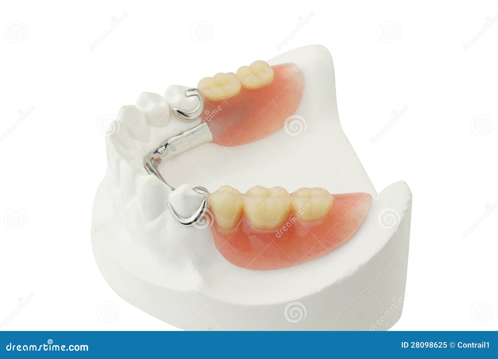 Dentier partiel image stock. Image du inférieur, médecine - 28098625