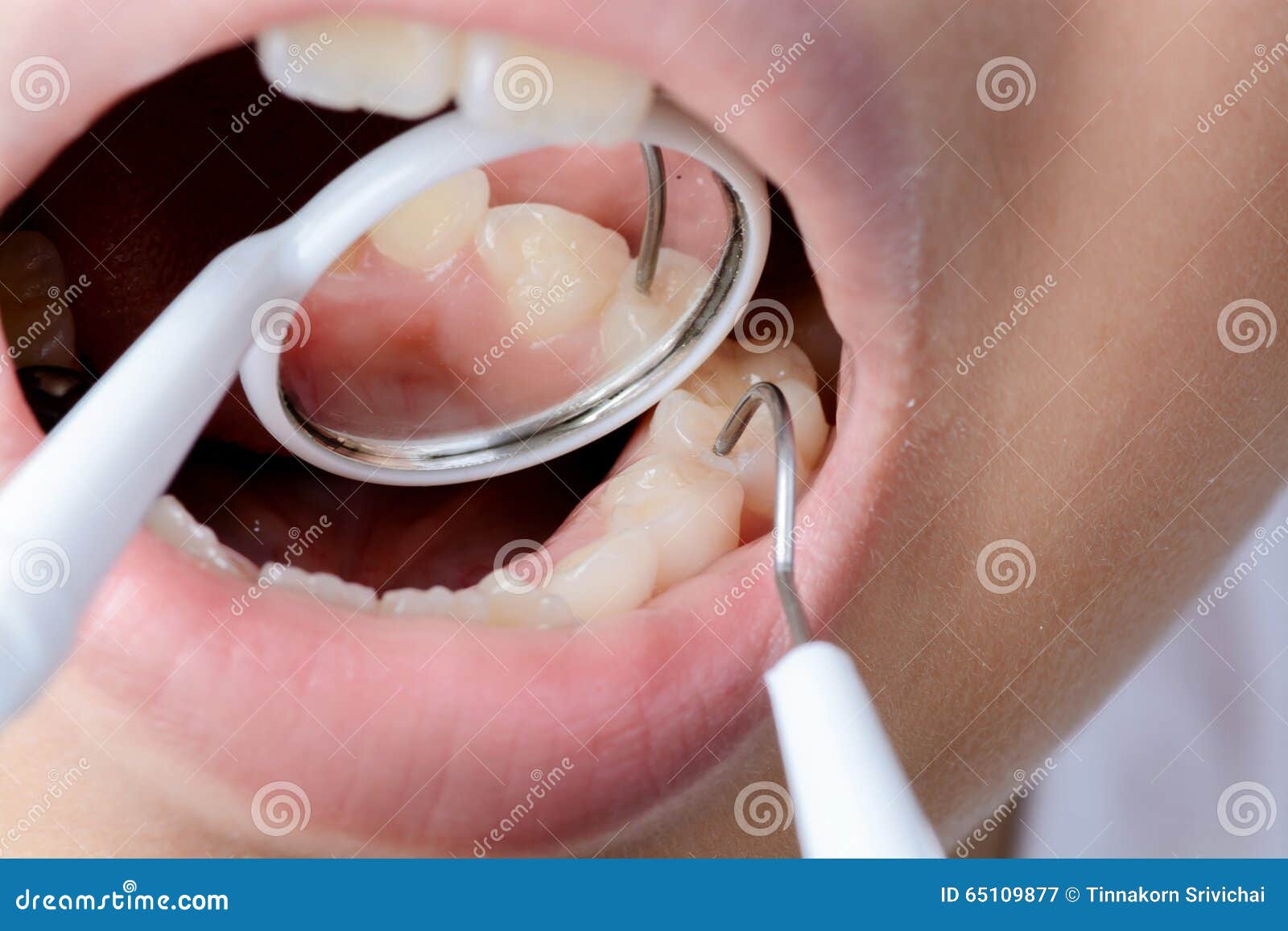 Dentist check boy teeth stock image. Image of healthcare - 65109877