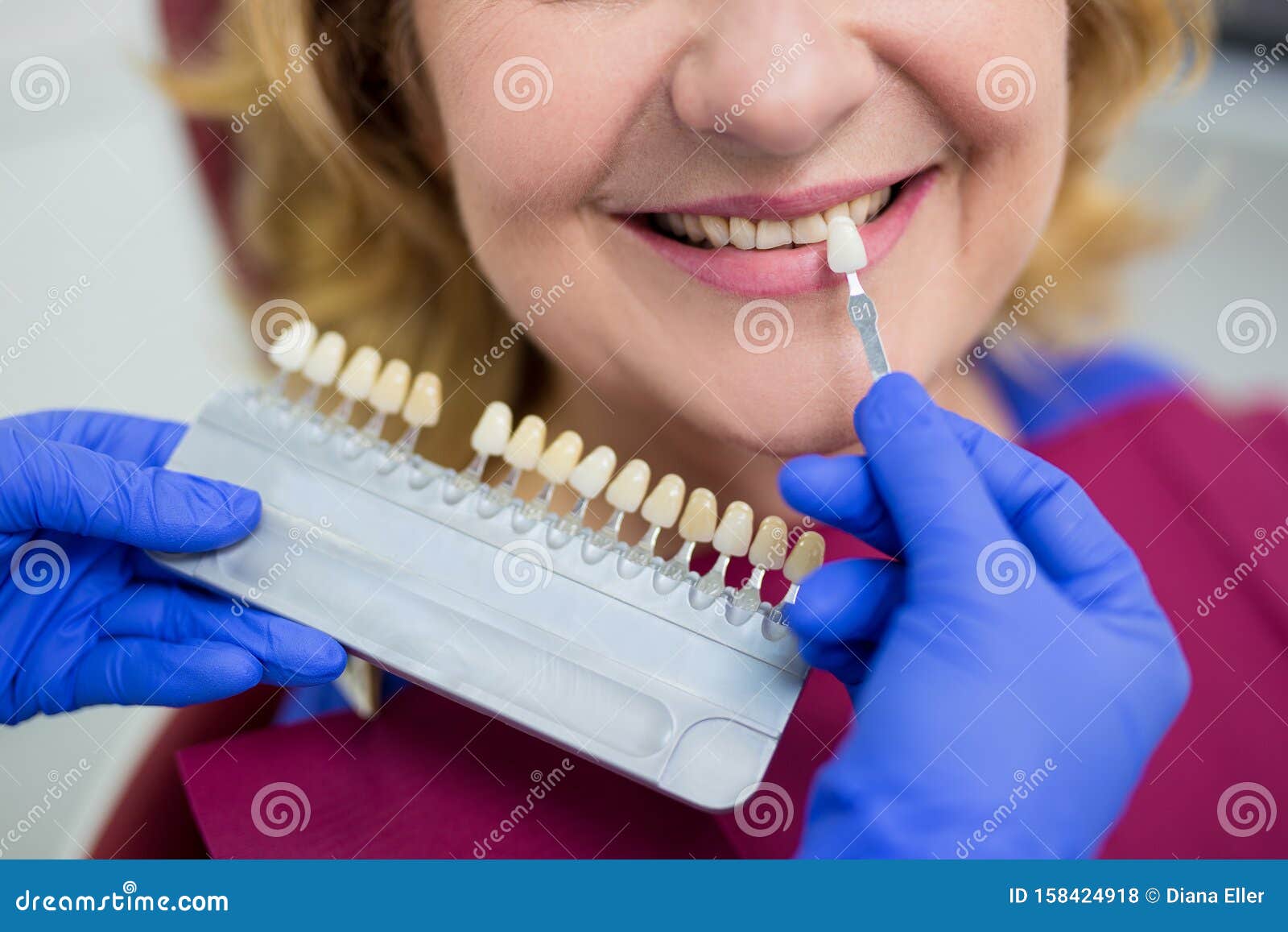 Dentist Checking the Level of Teeth Whitening the Patient`s Teeth Stock ...
