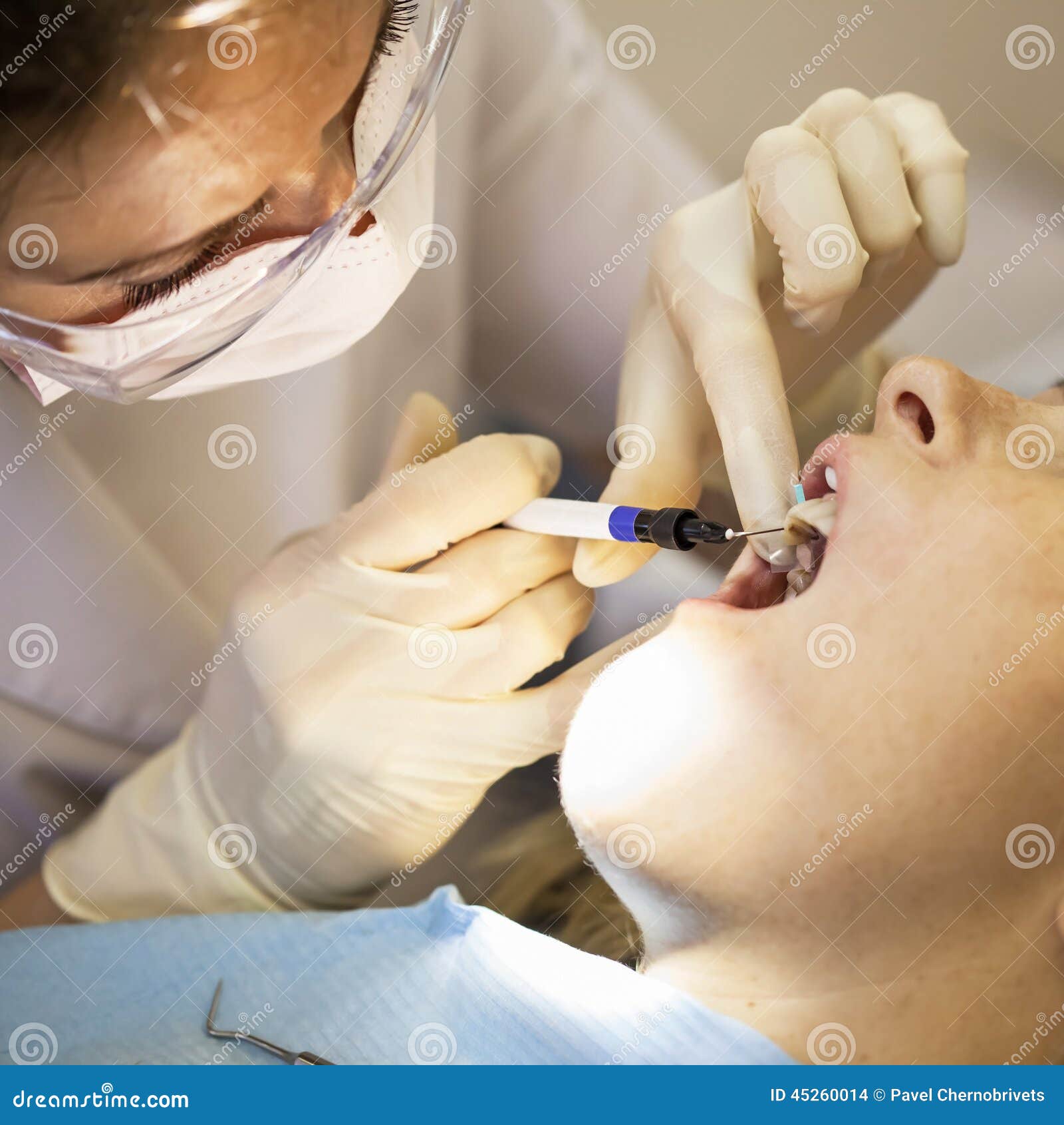 Dentist Curing a Female Patient Stock Photo - Image of caries, dentist ...