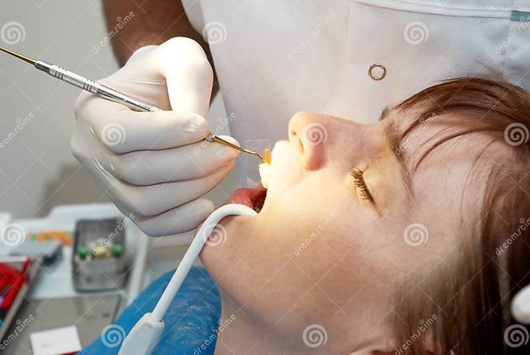 Dentist Curing the Patient S Stock Photo - Image of medicine, glove ...