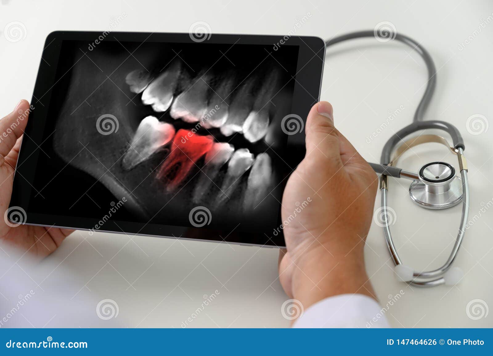Dentist Dental Tool To Teeth X-ray Work Looking at Teeth X-ray on ...