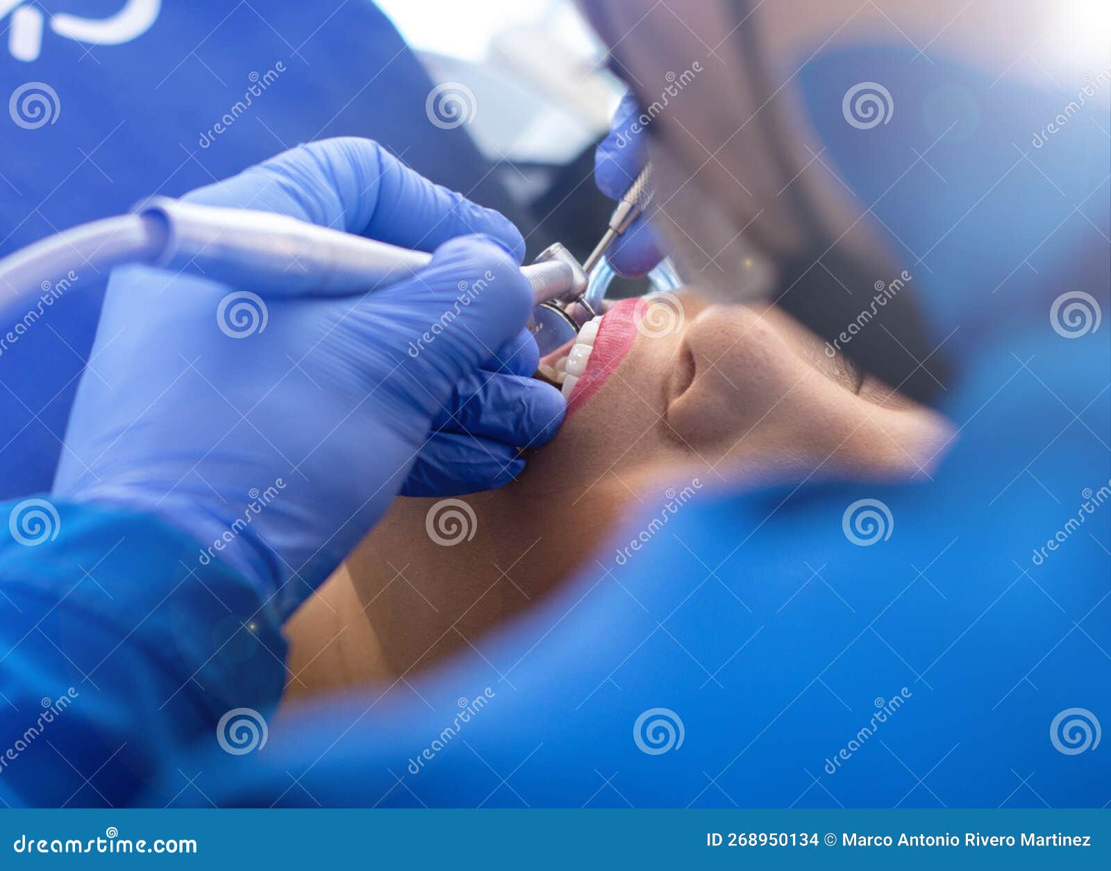 During The Operation, The Dentist Holds Implantation Tools With A ...