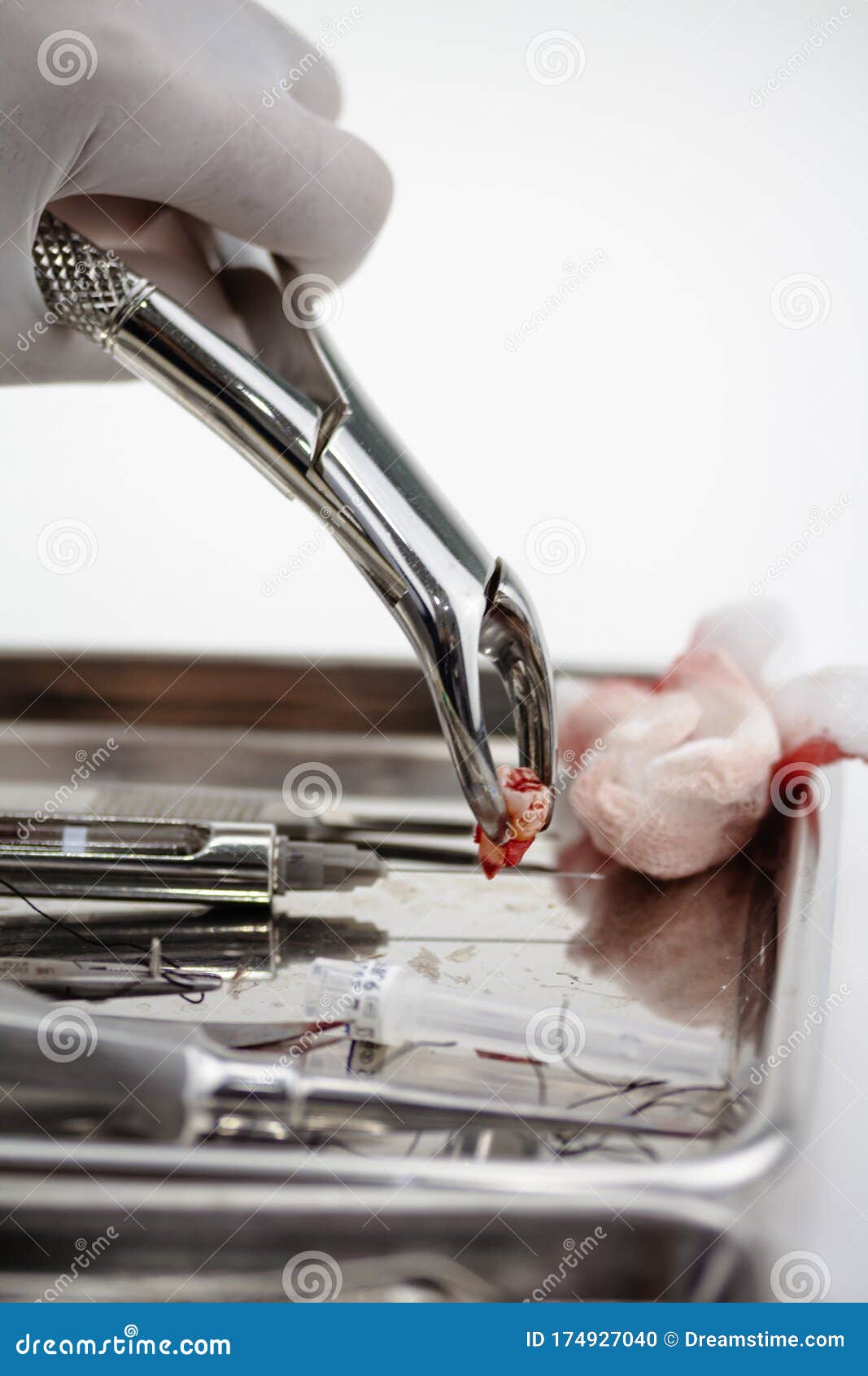 Dentist Equipment - Surgical Extraction of Wisdom Tooth Stock Photo ...