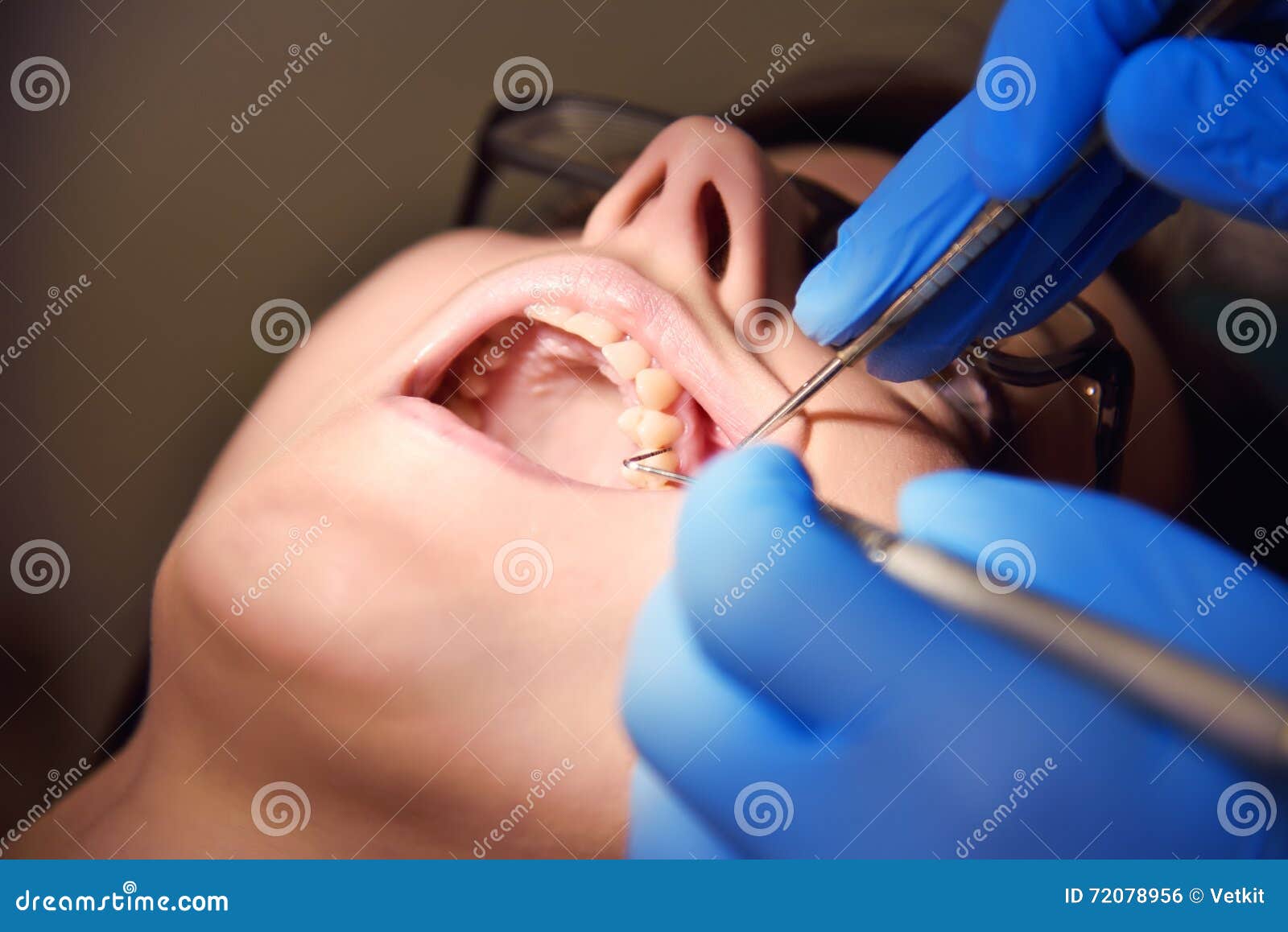 Dentist Examining a Patient S Teeth Stock Photo - Image of doctor ...