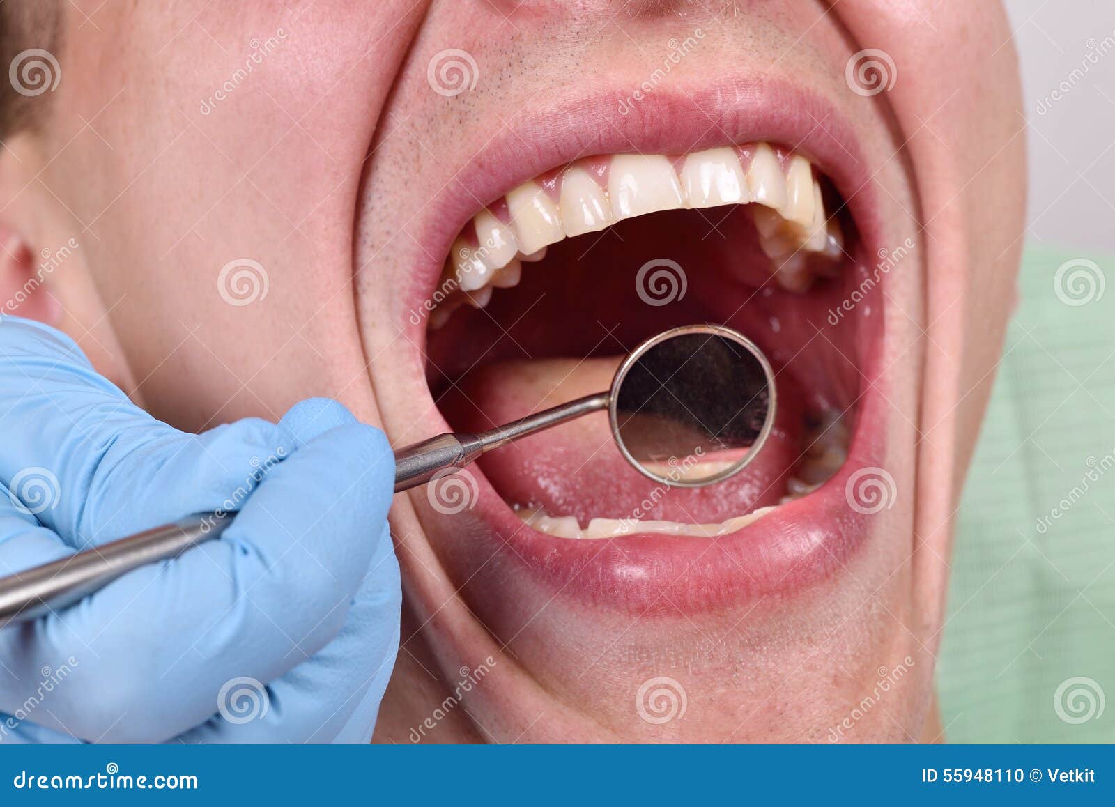 Dentist Examining Patient S Teeth Stock Photo - Image of caries ...