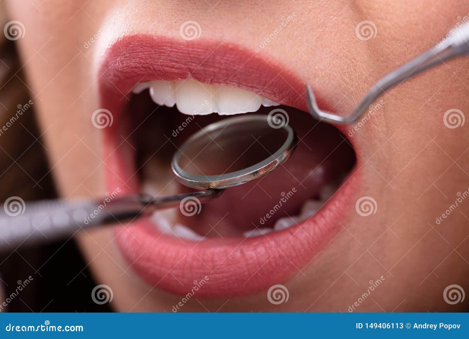 Dentist Examining Teeth stock image. Image of health - 149406113