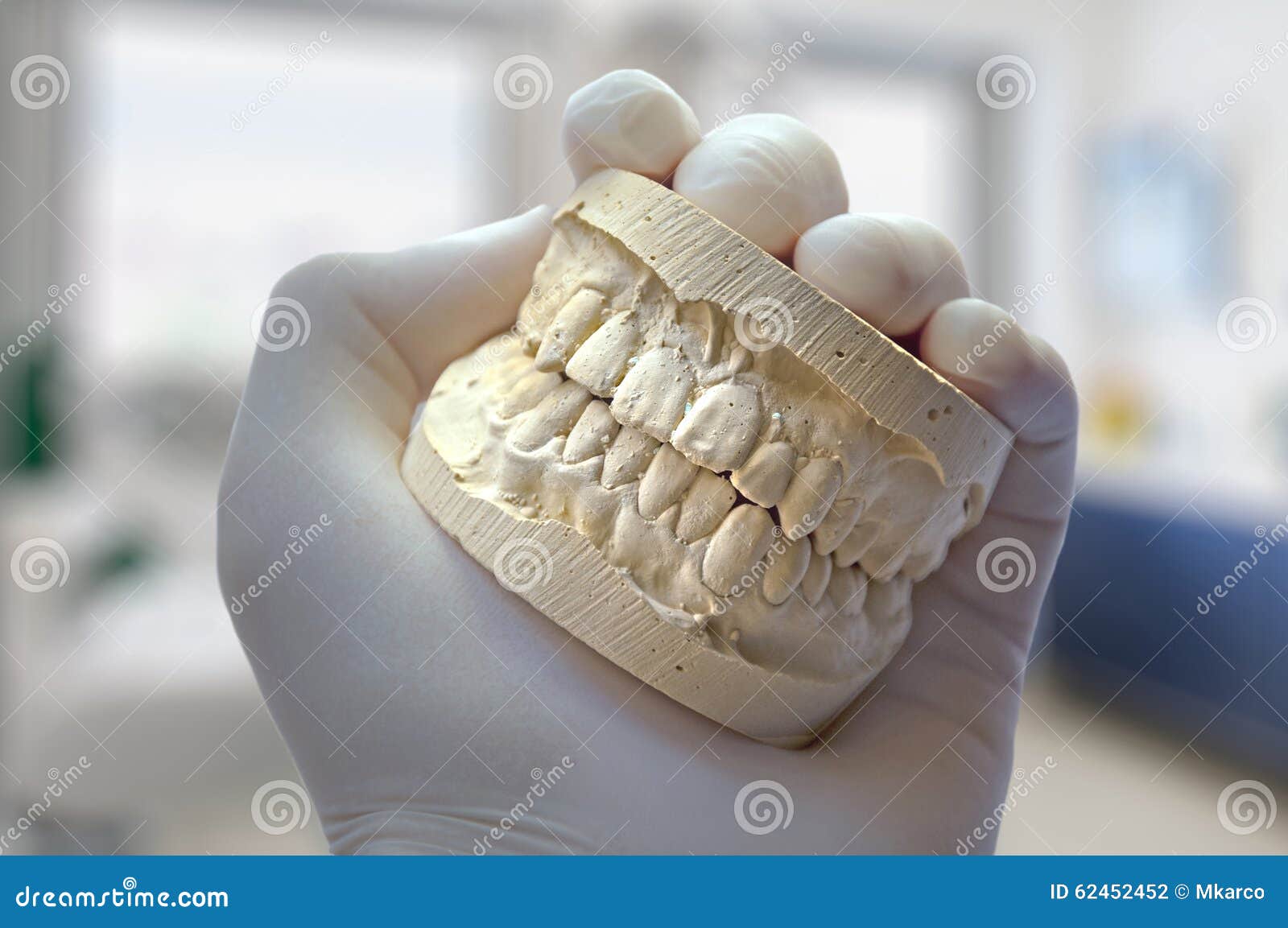 Dentist Hand Show Model Teeth Stock Photo - Image of production, molar ...