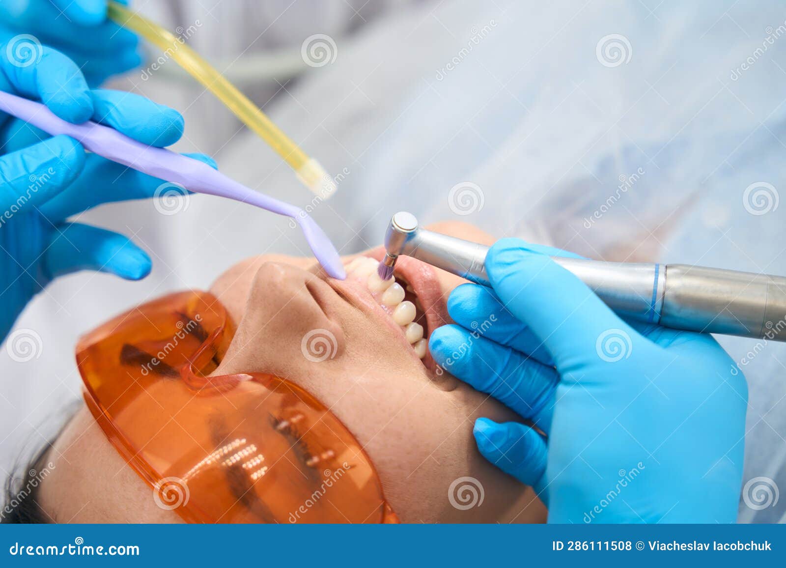 Dentist with the Help of an Assistant Fills Patients Tooth Stock Photo ...
