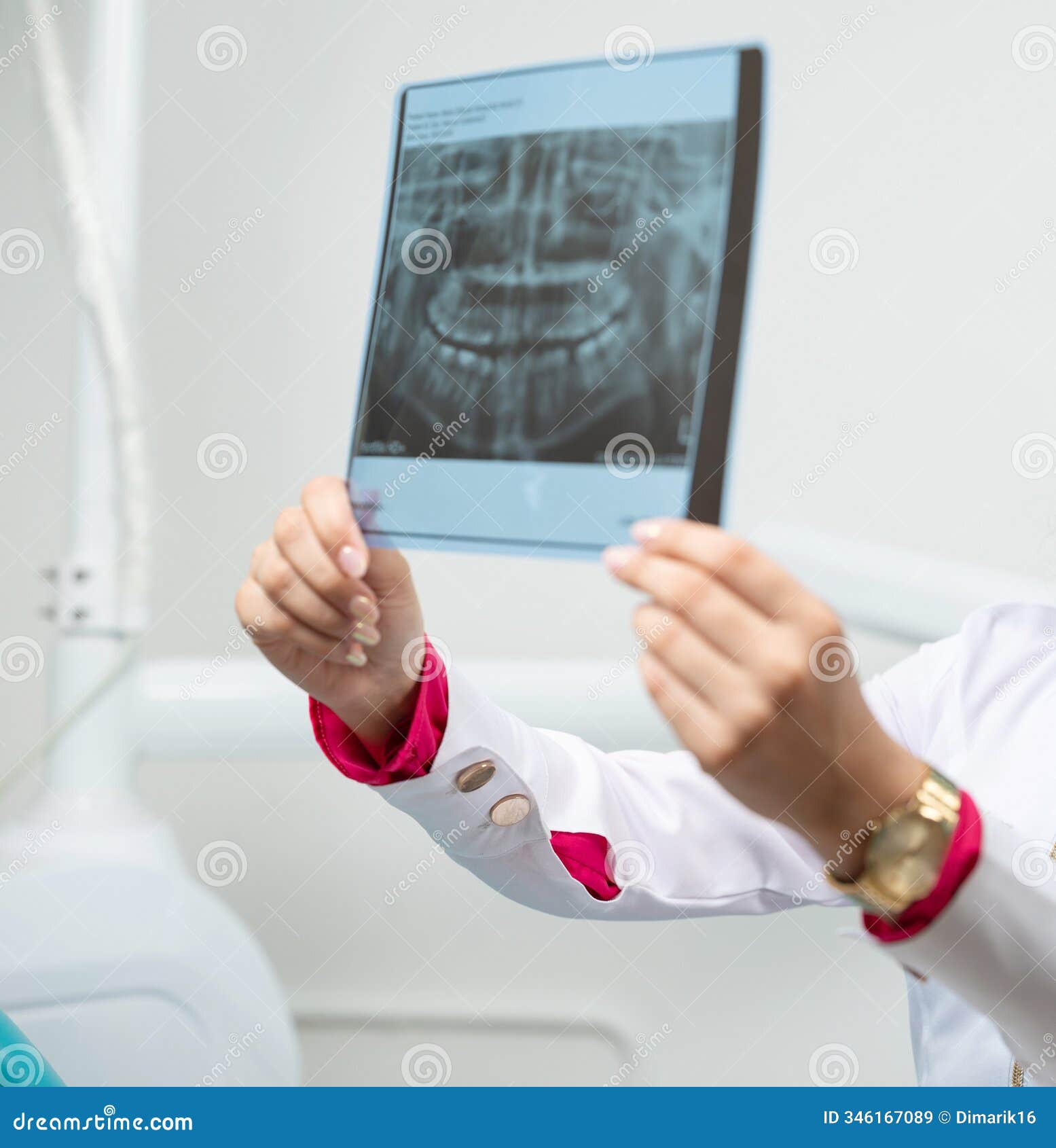 Dentist hold xray scan stock image. Image of health - 346167089