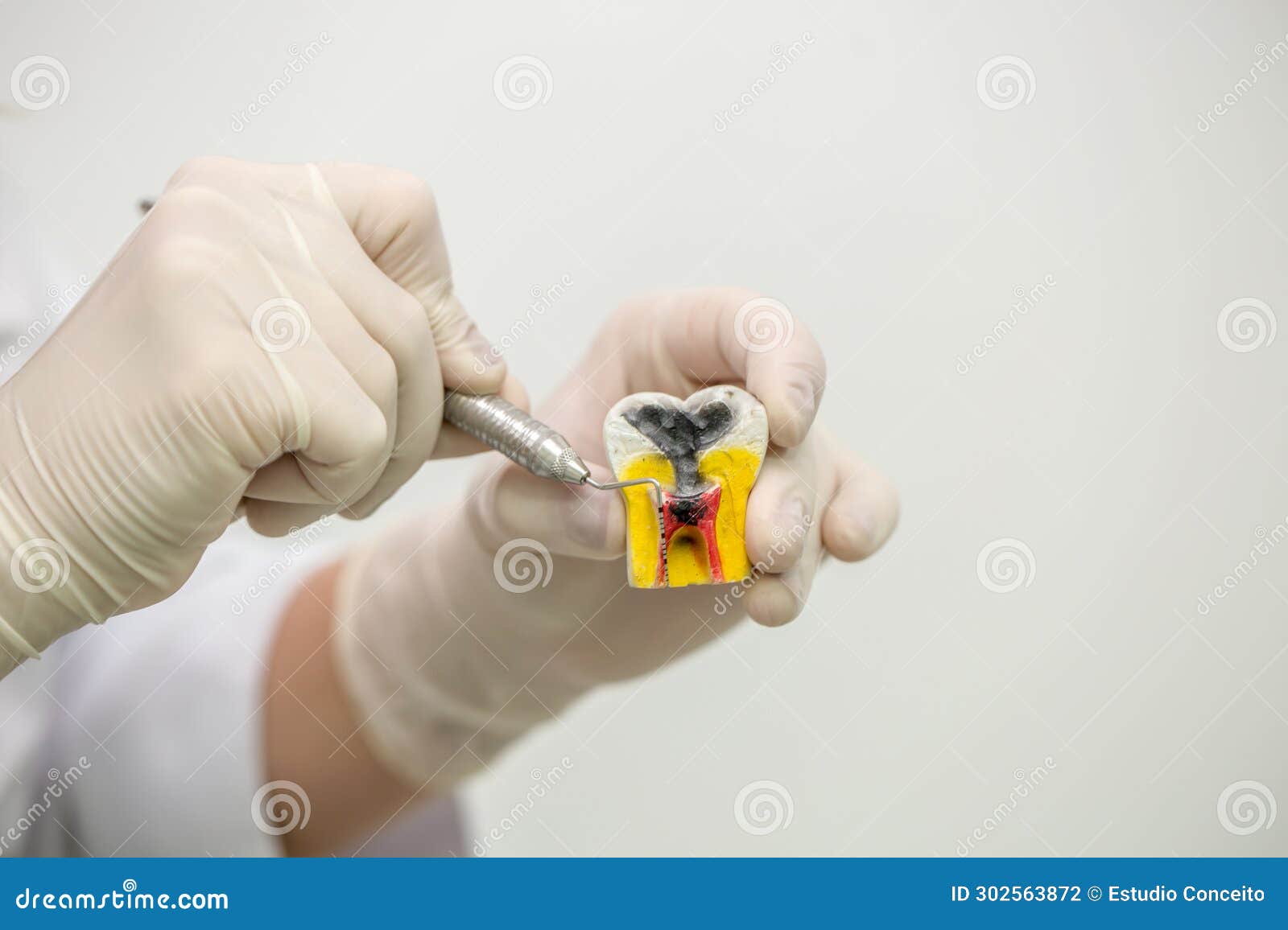 Educational Model Of Jaw Section With Teeth, Paste And Brush On White ...