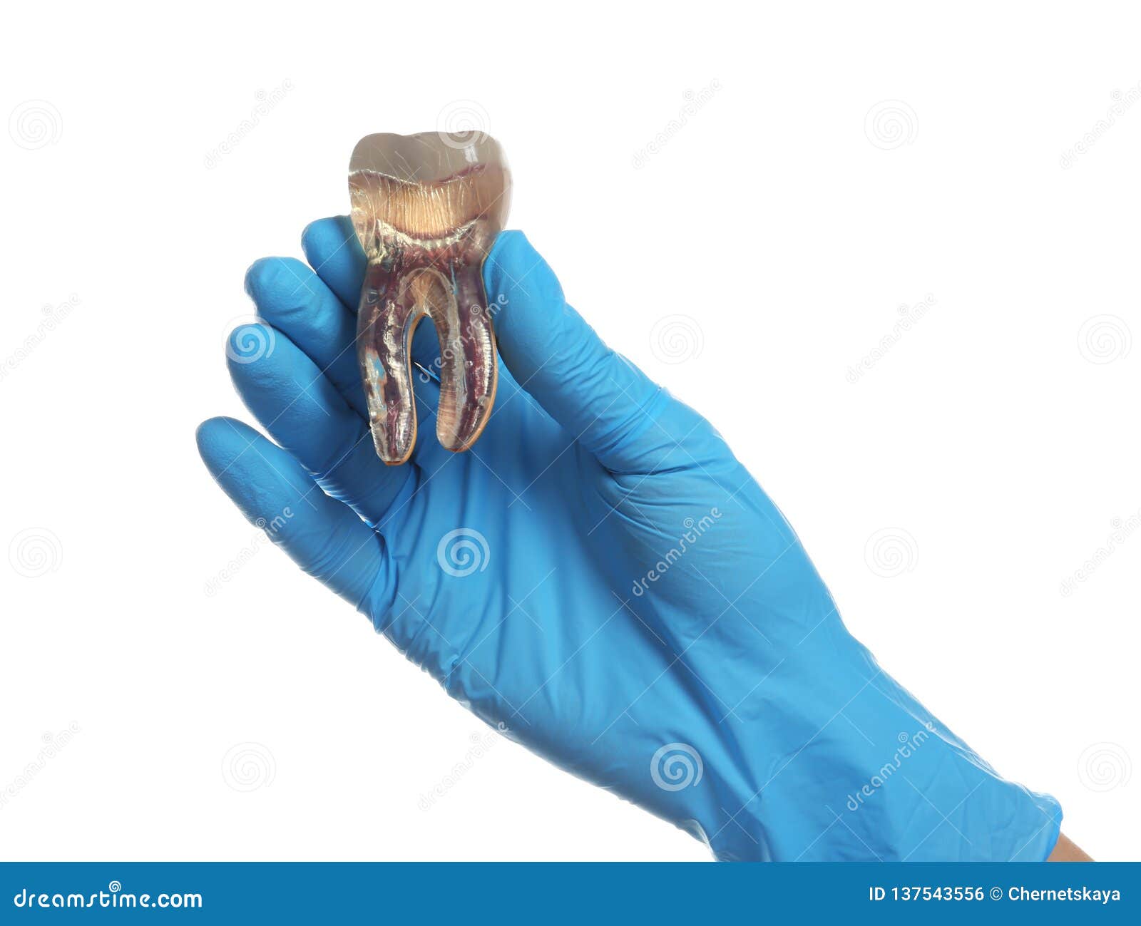 Dentist Holding Educational Model of Tooth in Hand on White Stock Photo ...