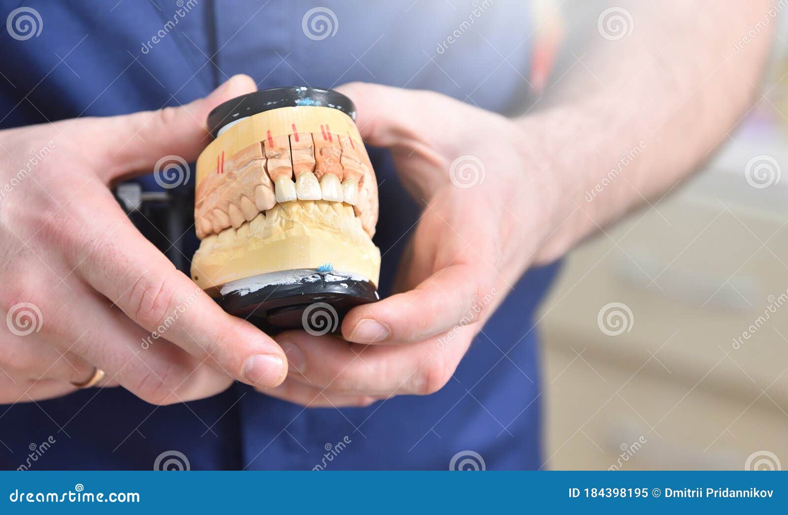 Dentist Holds Jaw Layout To Create Ceramic Teeth Royalty-Free Stock ...