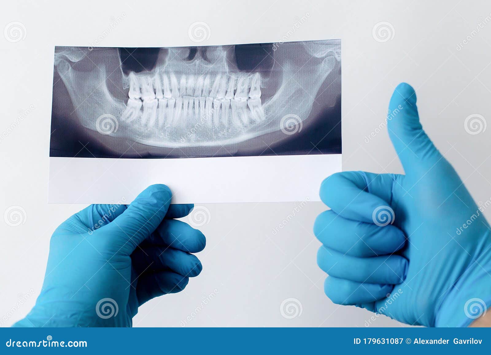 Dentist Holds Photo of Teeth in His Hands Stock Image - Image of heal ...