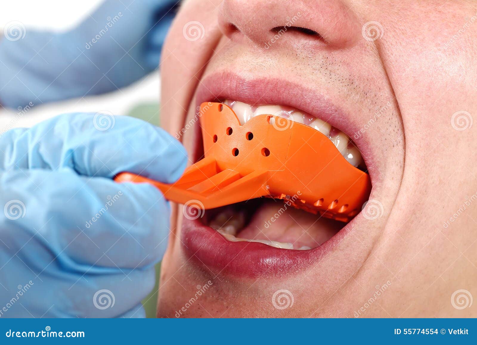 Dentist inserts blade stock photo. Image of dentist, lips - 55774554