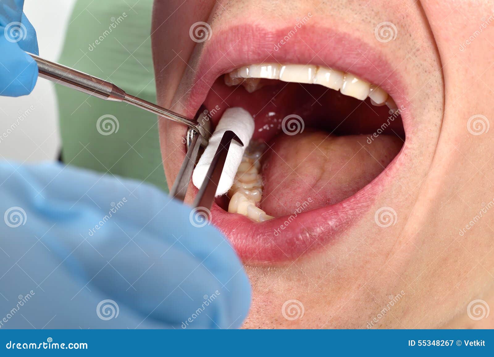 The Dentist Inserts the Swab Stock Image - Image of examination ...