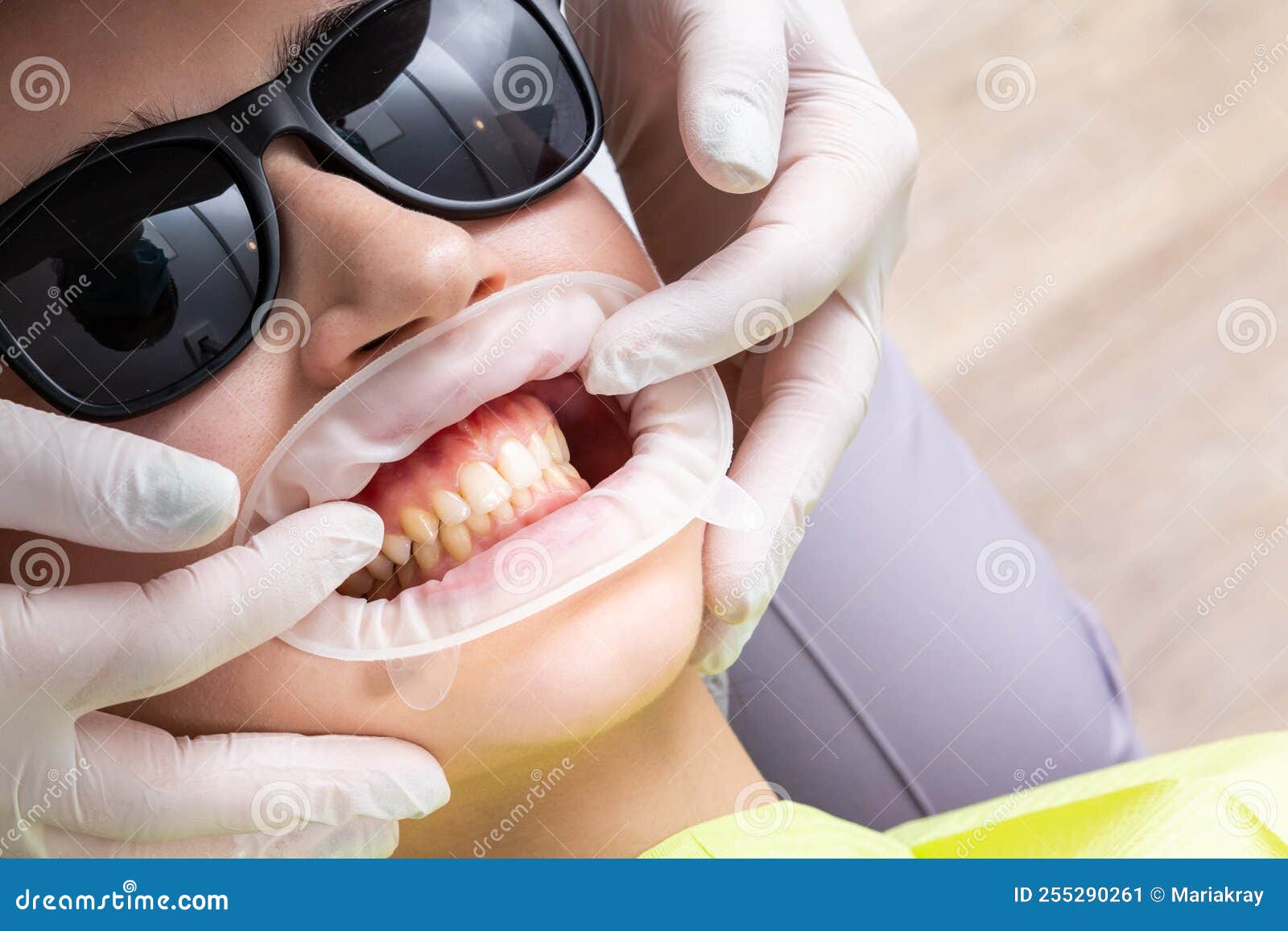Dentist Installing a Patient Cheek Retractor in Dentist Office Stock ...