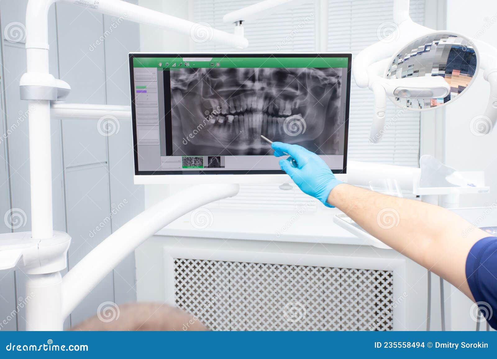 Dentist Looking Teeth on Digital X-Ray Computer Monitor Stock Photo ...