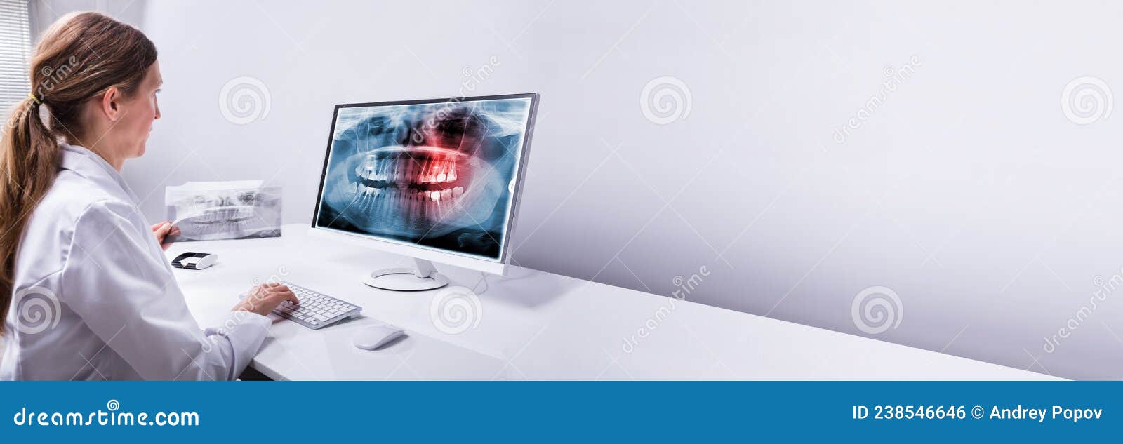 Dentist Looking at Teeth Xray Scan Stock Photo - Image of looking ...