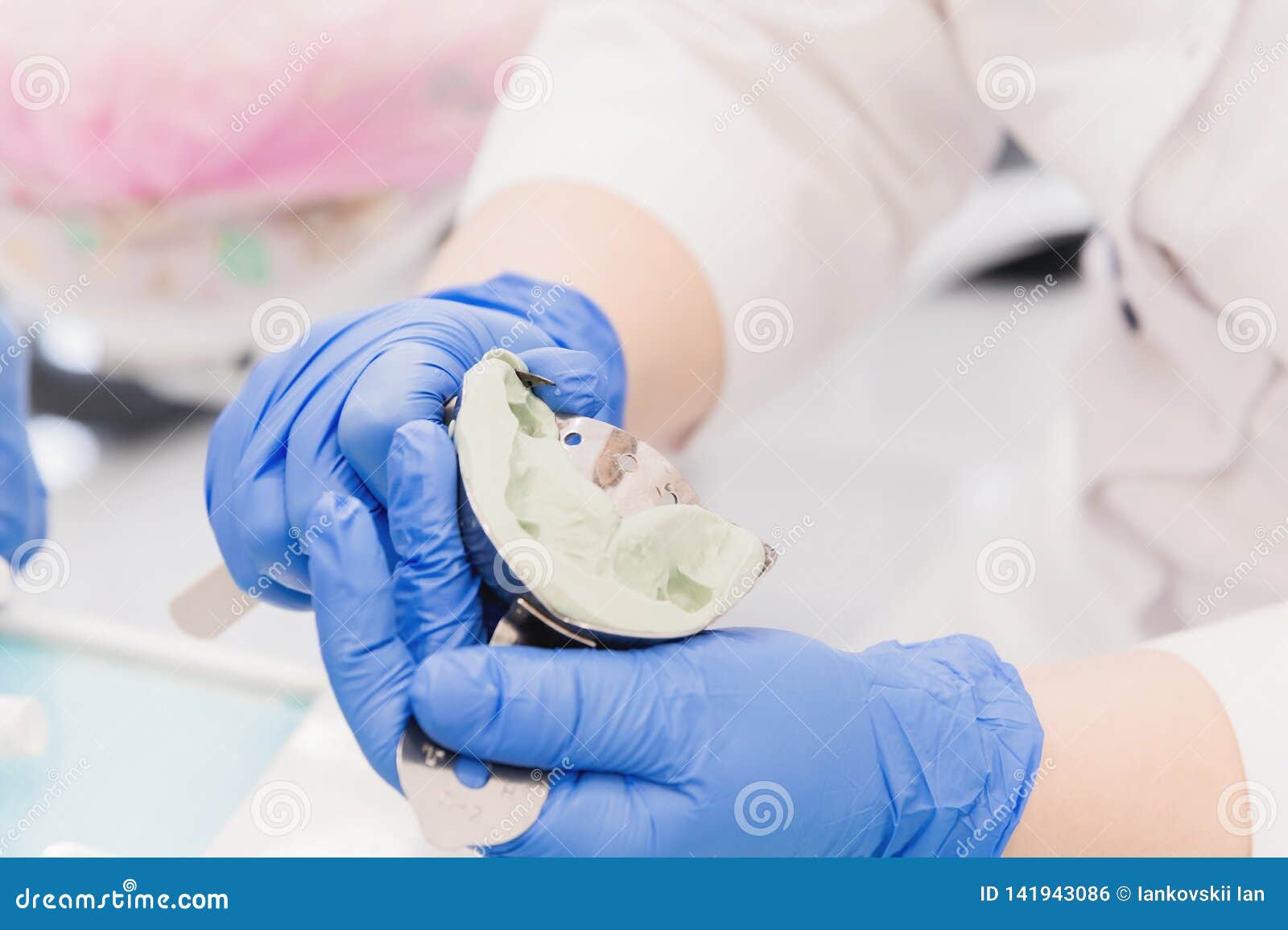 A Dentist Makes a Cast of Teeth. Close-up of a Doctor`s Hands Stock ...