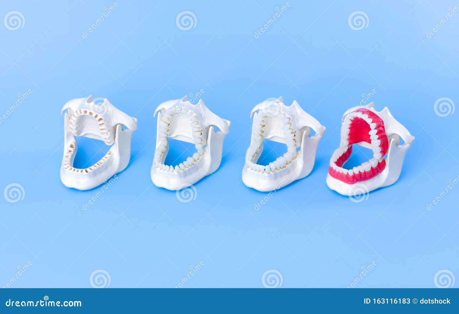 Dentist Orthodontic Teeth Models Stock Image - Image of healthcare ...
