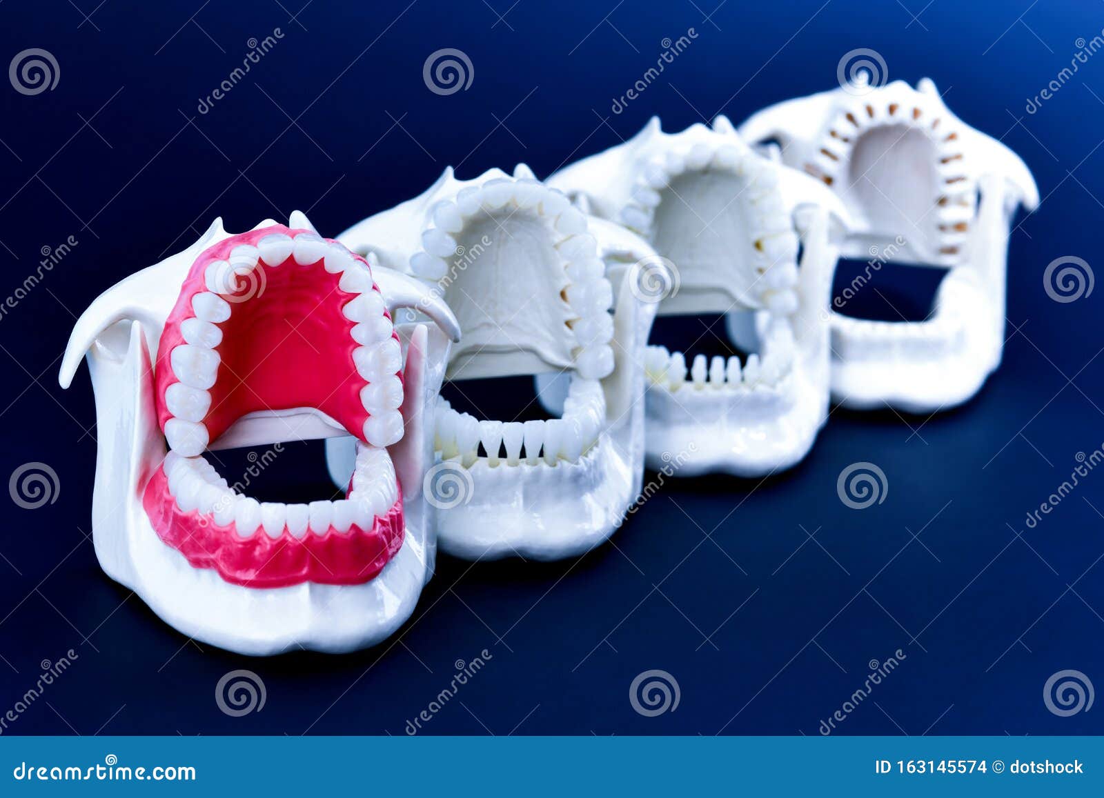 Dentist Orthodontic Teeth Models Stock Photo - Image of equipment ...