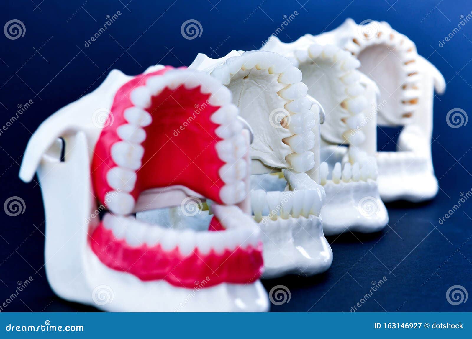 Dentist Orthodontic Teeth Models Stock Image - Image of braces, doctor ...