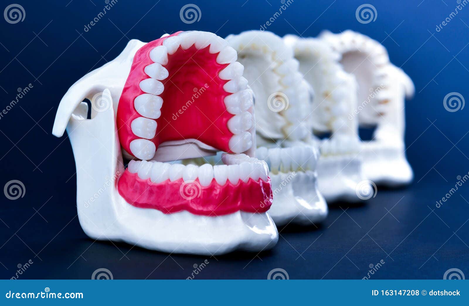 Dentist Orthodontic Teeth Models Stock Photo - Image of education ...