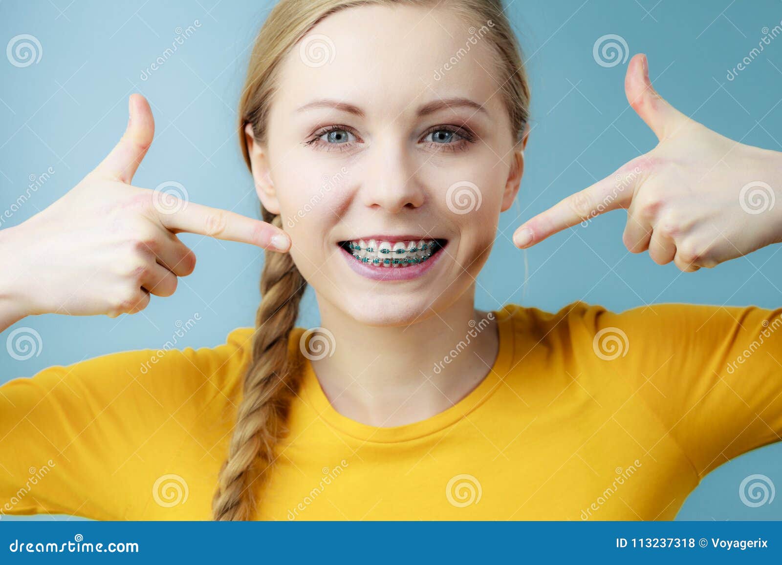 Young Woman Showing Teeth Braces Stock Photo - Image of showing ... Young Woman Showing Teeth Braces Stock Photo - Image of showing ...