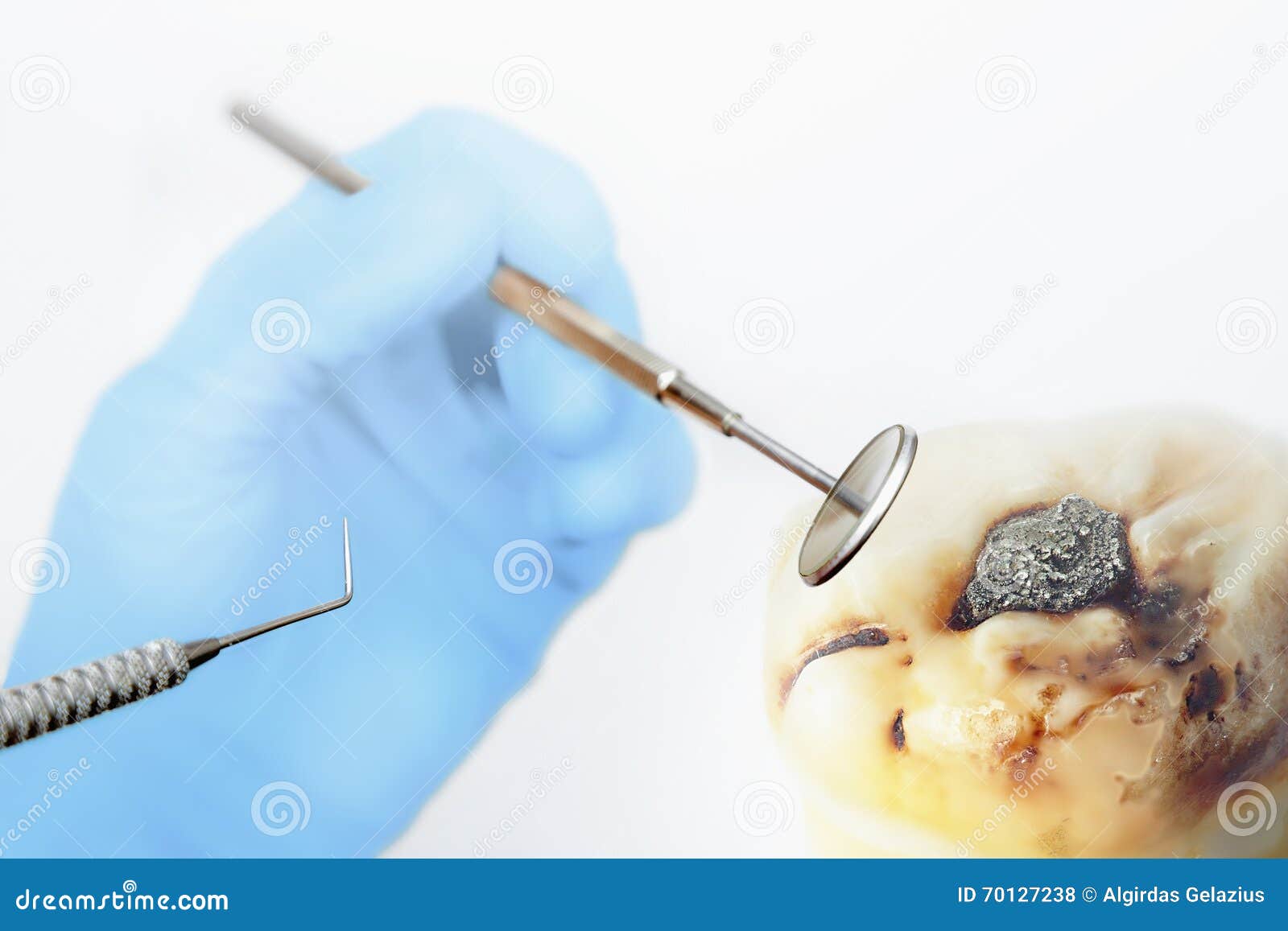 Dentist Wisdom Tooth Forceps Instruments Stock Photography ...