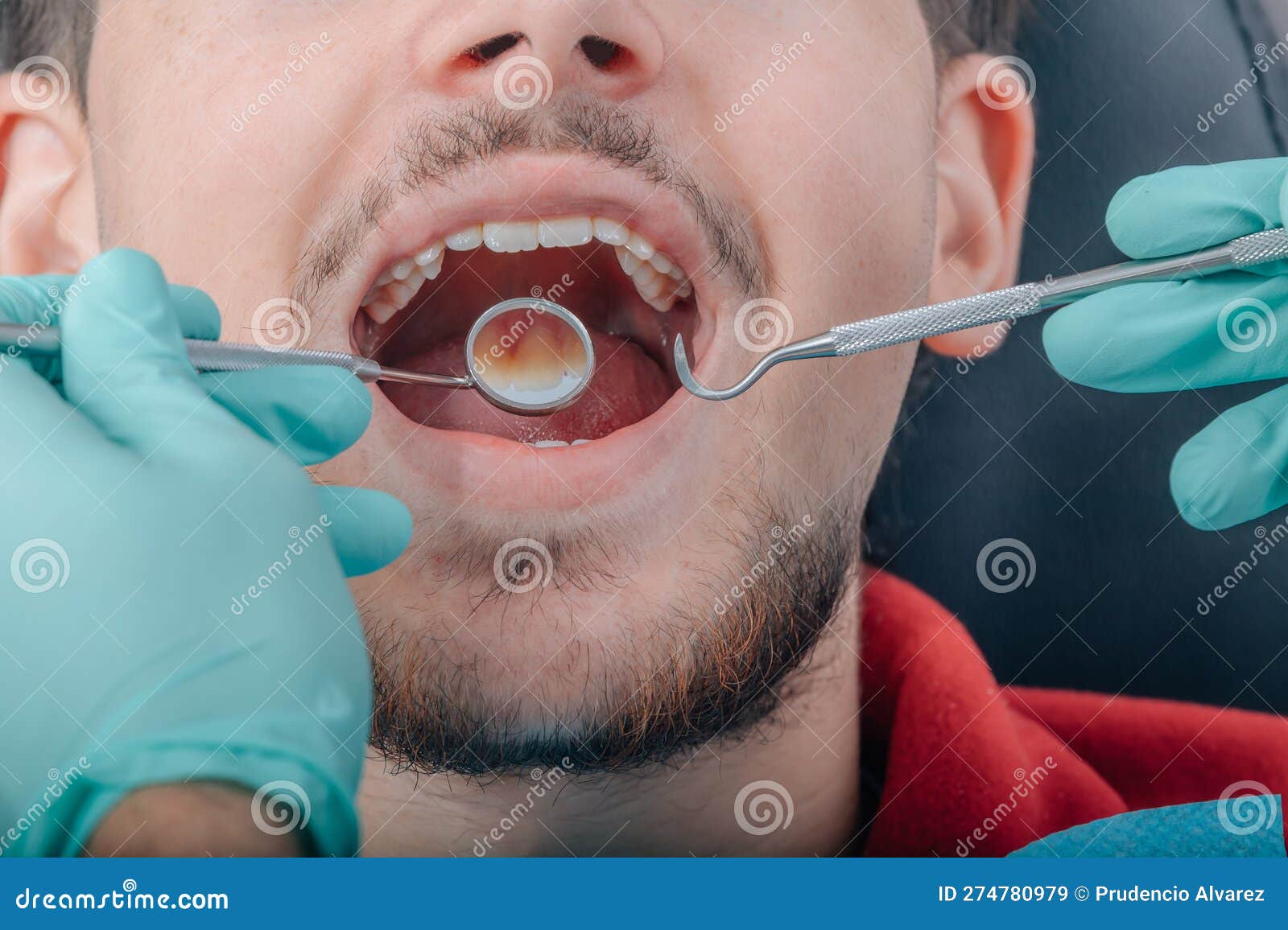 Dentist with Tools in the Mouth of the Patient Stock Image - Image of ...
