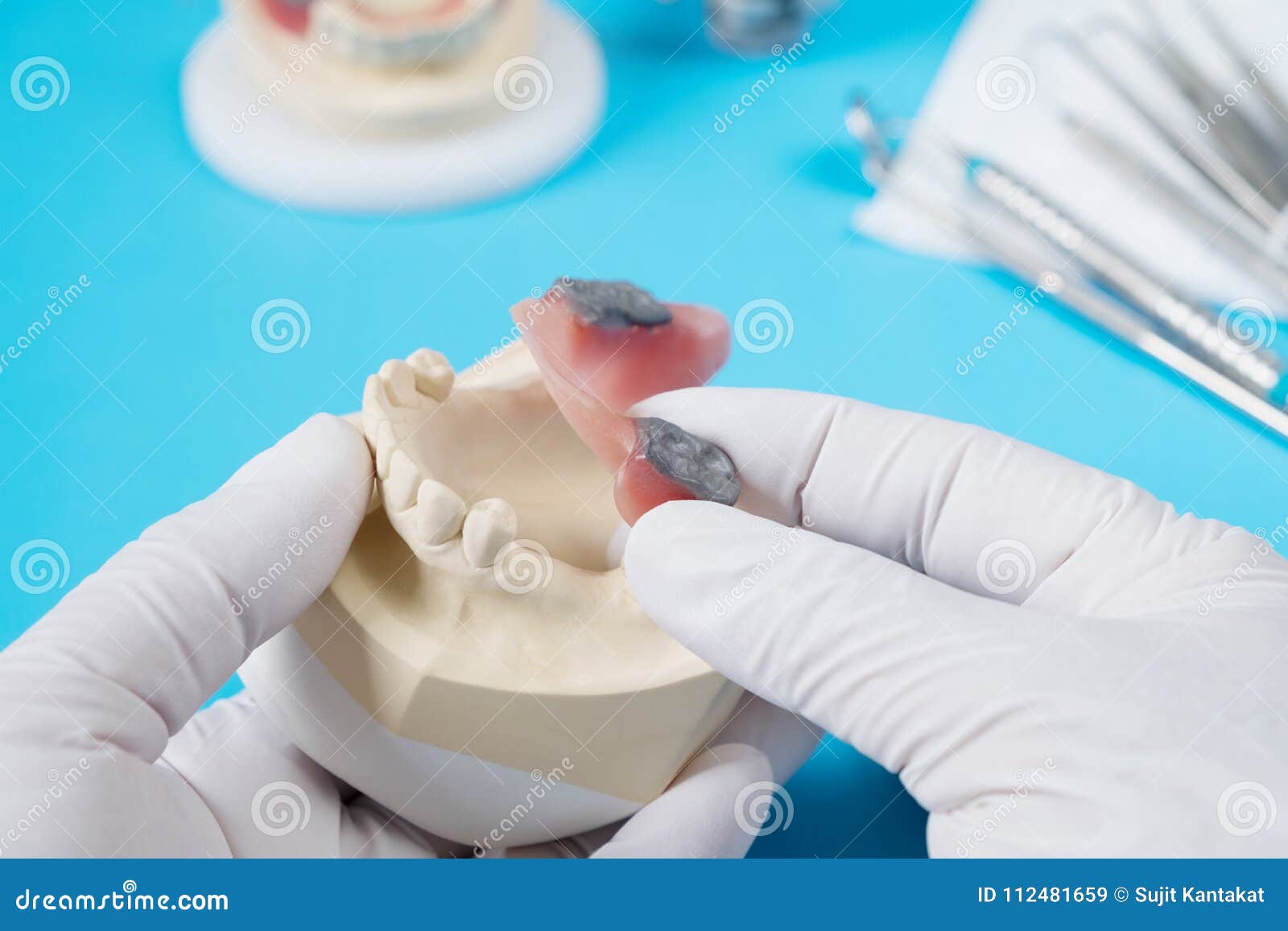 Dentist Tools and Prosthodontic Model. Stock Image - Image of clean ...