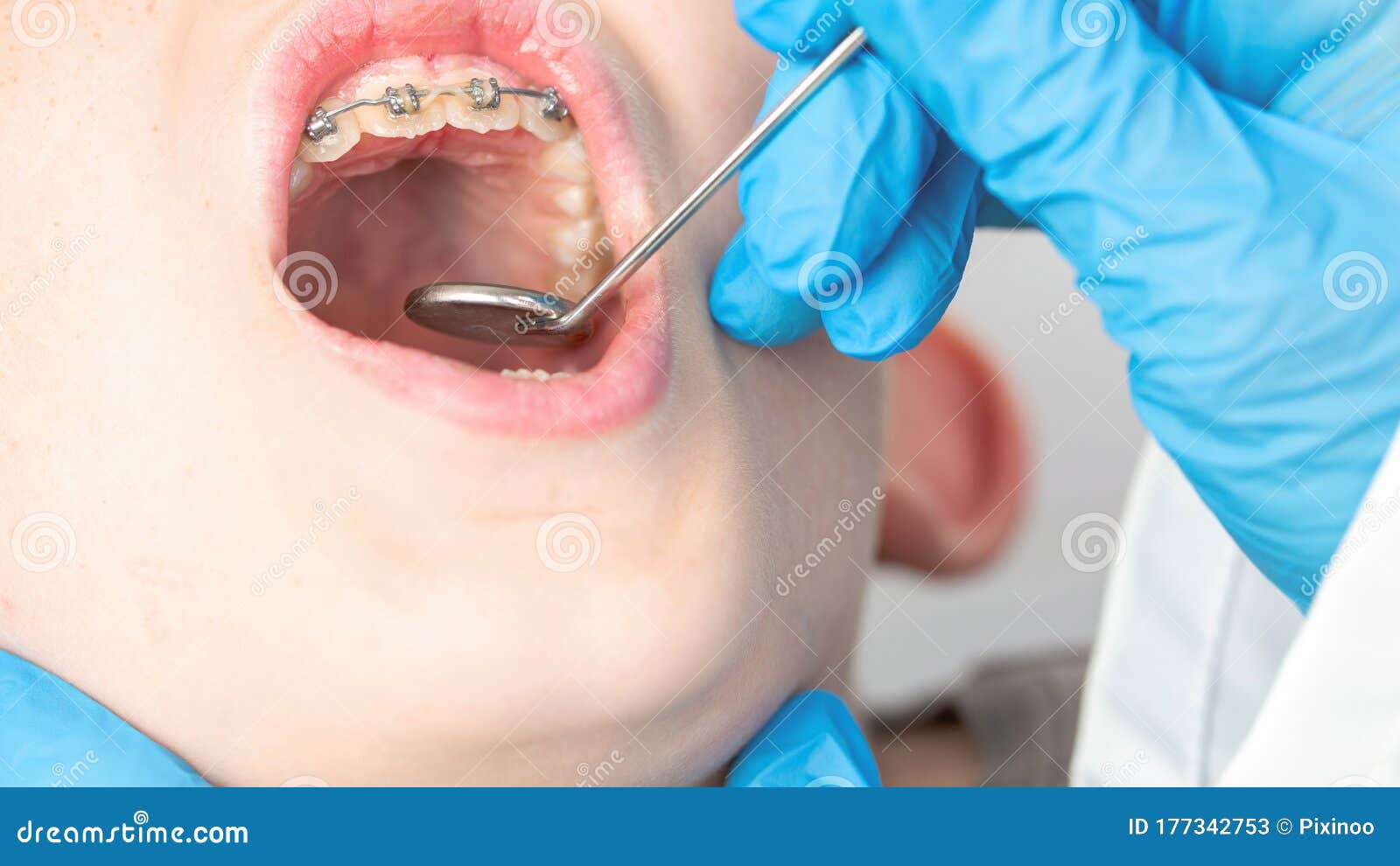 Dentist Using an Instrument To Visualize the Teeth of a Child Patient ...