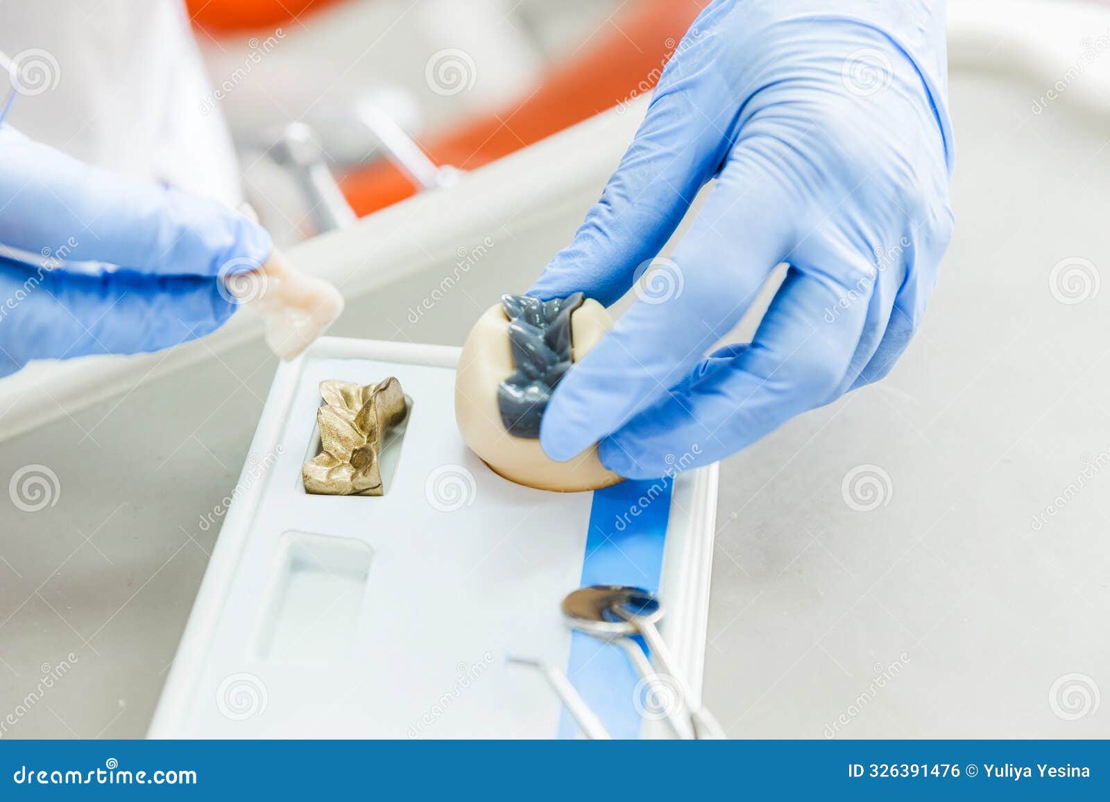 Dentist Demonstrating Tooth Filling Process Stock Photo - Image of ...