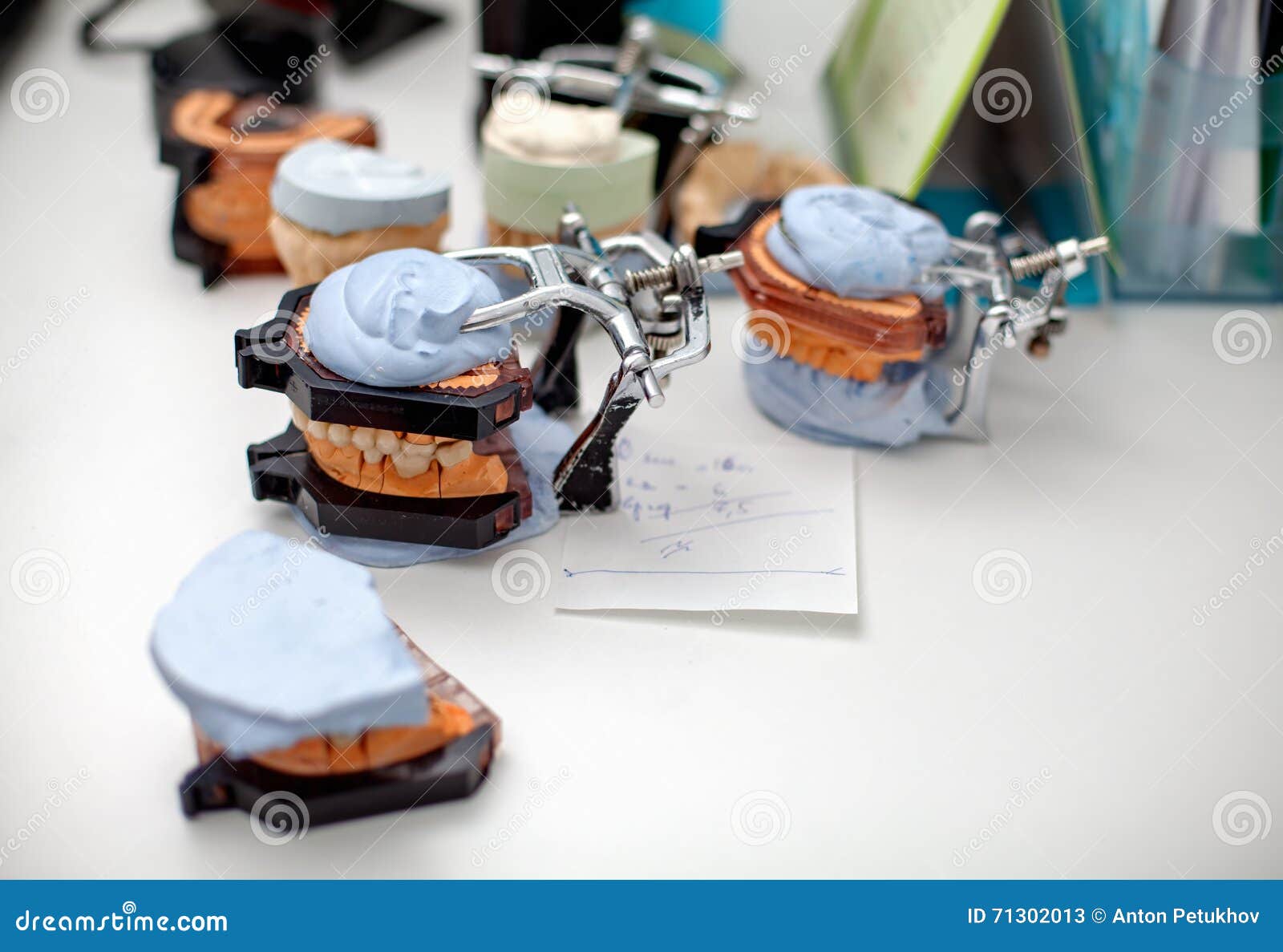 Dentist Working with Dental Mold at Clinic Stock Image - Image of mouth ...