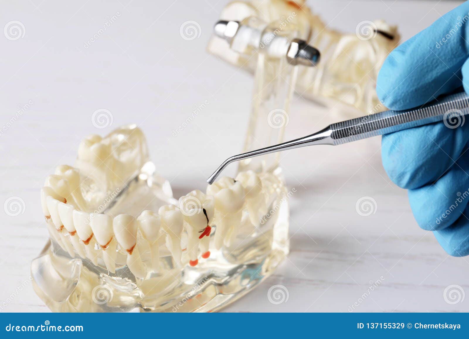 Dentist Working With Model Of Oral Cavity With Teeth At Table Royalty ...