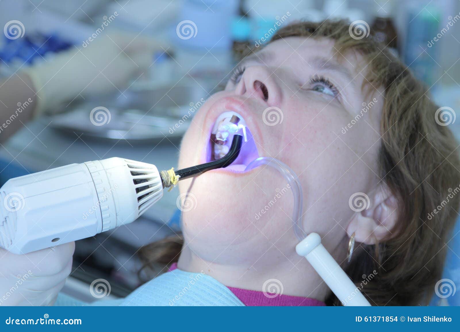 Dentist working in mouth. stock photo. Image of operation - 61371854