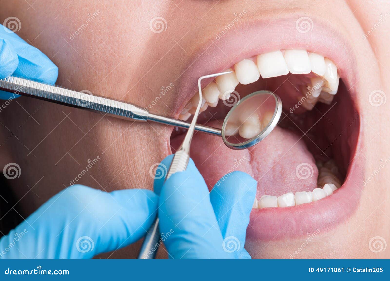 Dentista Que Limpia Los Dientes Perfectos Imagen de archivo - Imagen de ...