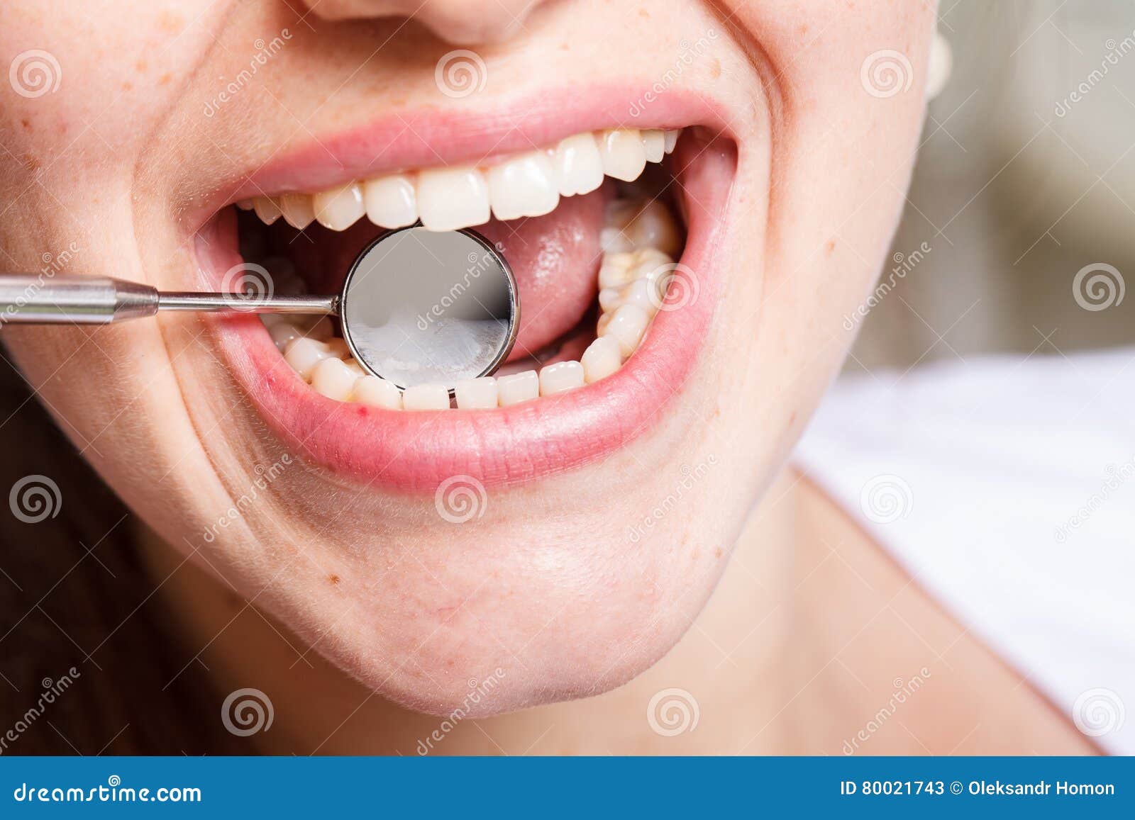 Dentistry, Dental , Mouth and Teeth Close Up Smiling Stock Image ...