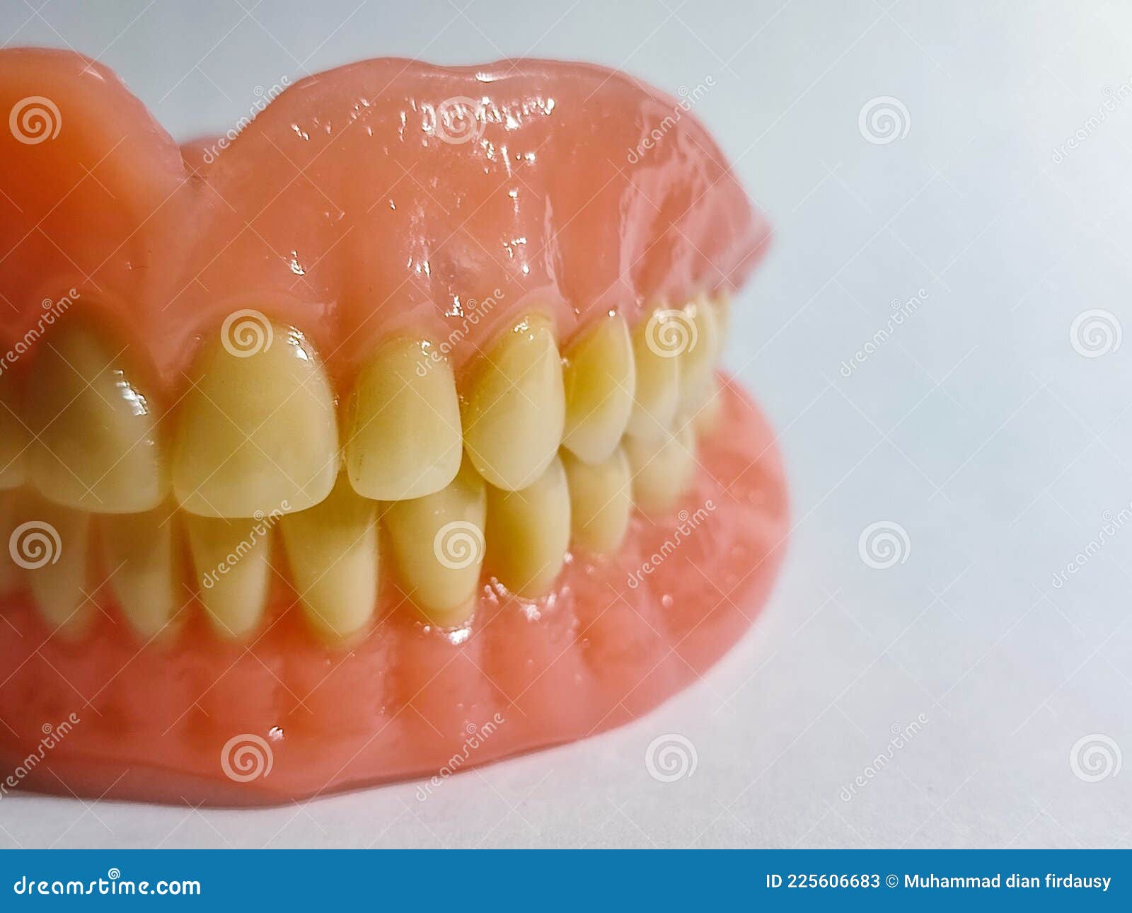 Dentistry Full Denture Close Up Showing Artificial Teeth and Gum Stock ...
