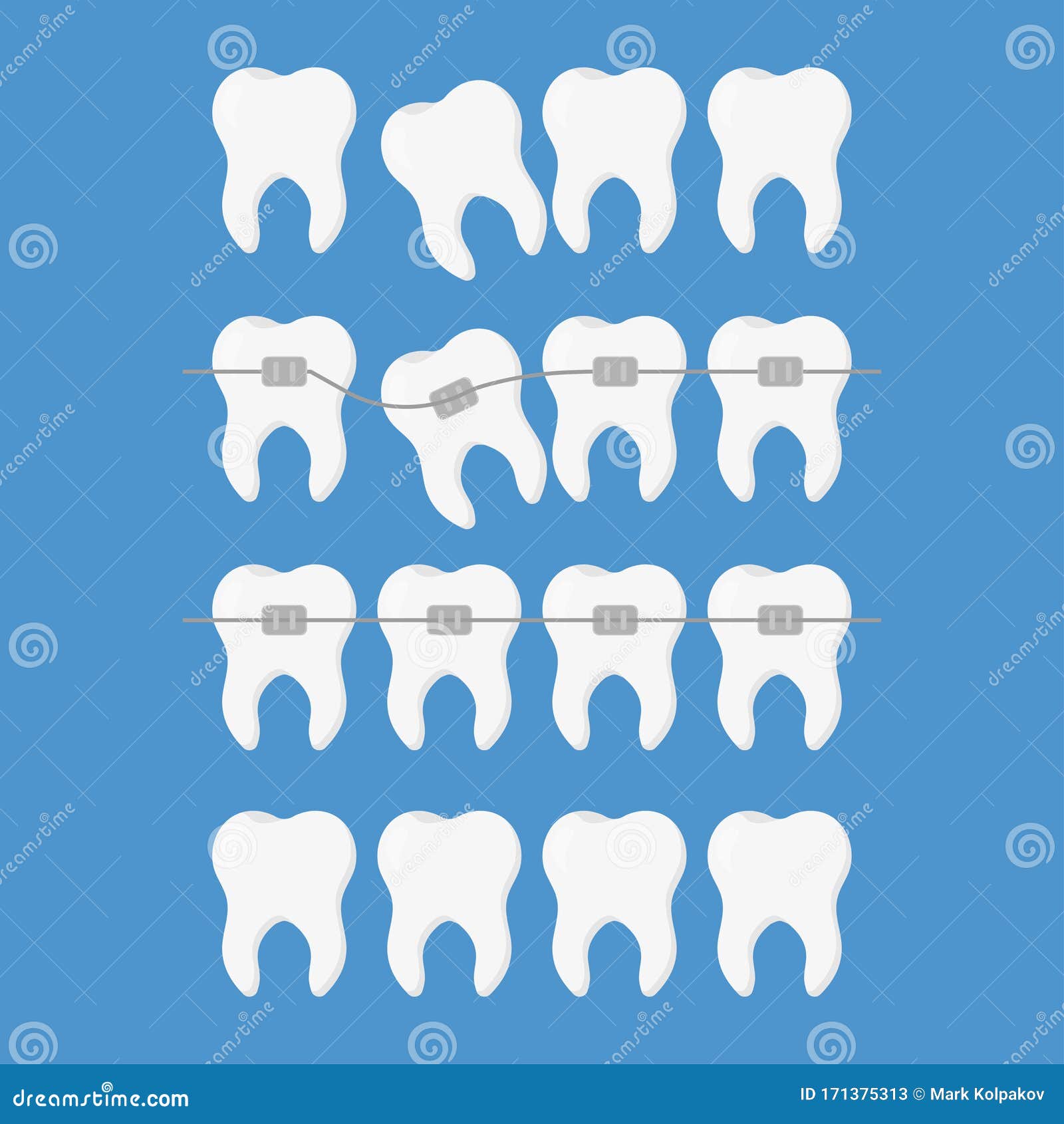 Teeth Before And After Braces. Funny Dental Illustration In Cartoon ...