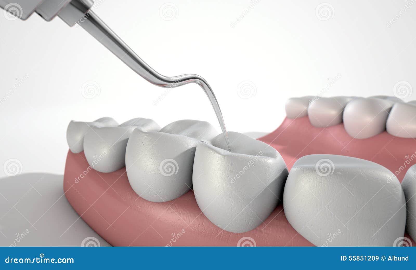 Dentists Probe Hook and Teeth Stock Illustration - Illustration of ...