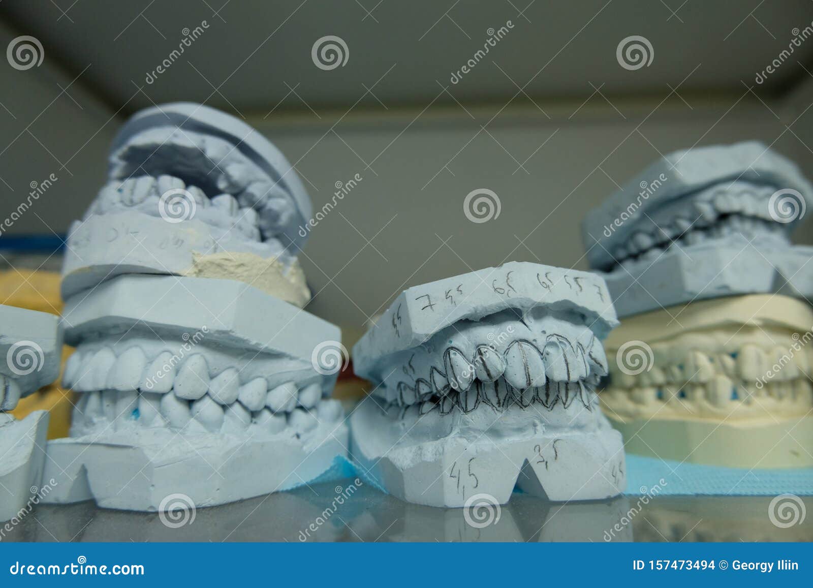 Dentoforms, Dental Tooth Model in Medical Cabinet Stock Photo - Image ...