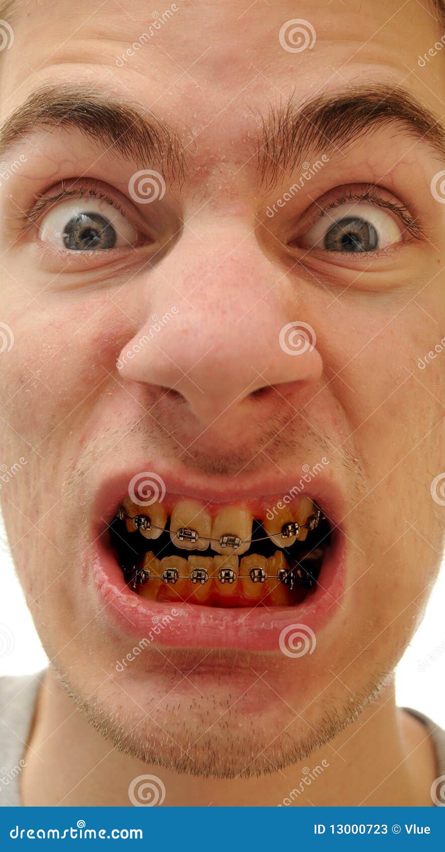 Dents jaunes image stock. Image du connaisseur, apparence - 13000723